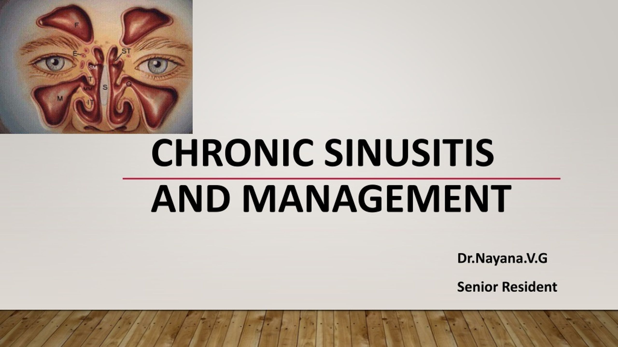 PPT - Chronic sinusitis and management PowerPoint Presentation, free ...