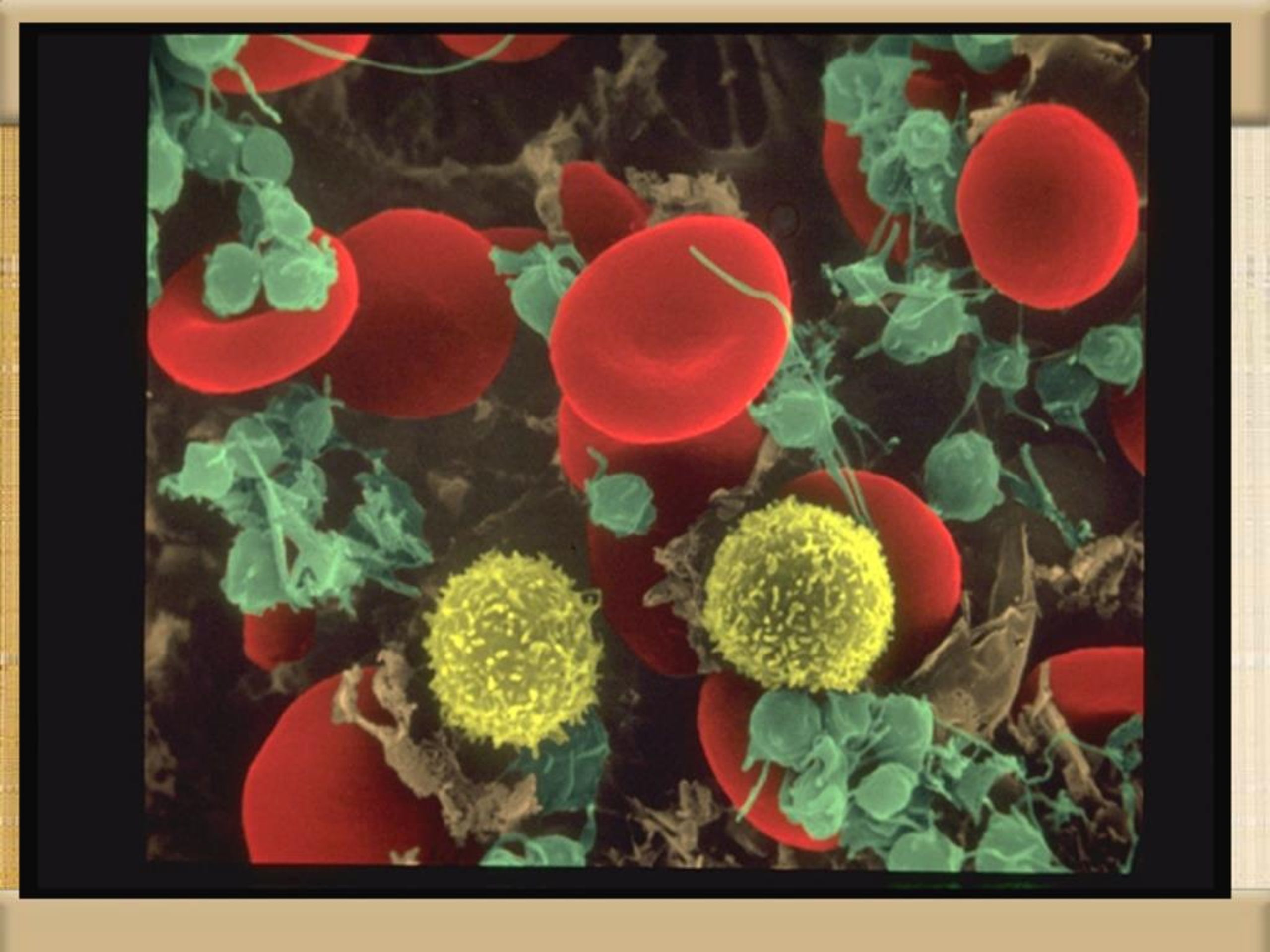 PPT - Comprehensive Overview of Bleeding Disorders and Clinical ...