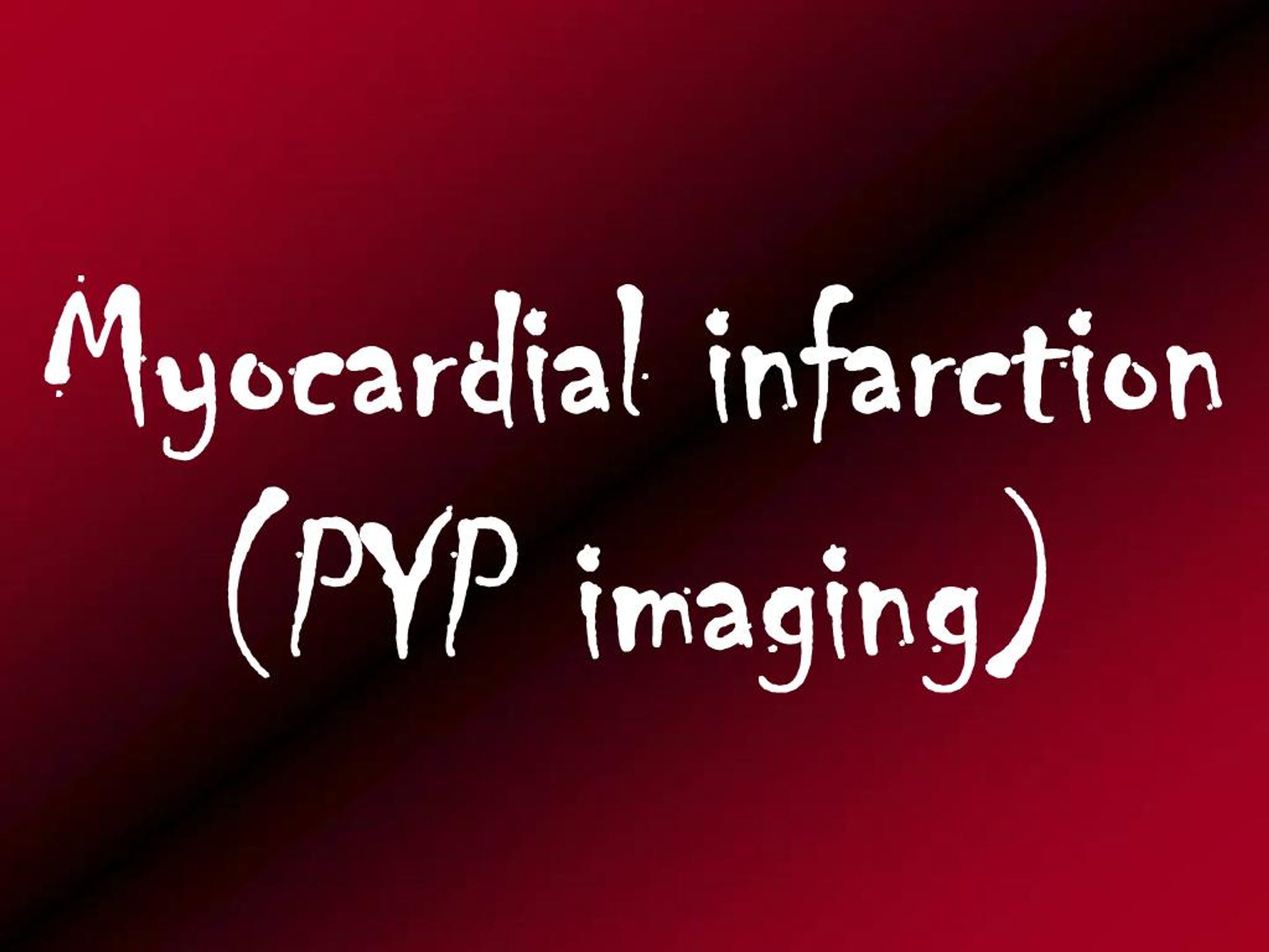 PPT - Comprehensive Analysis of Myocardial Infarction: PYP Imaging and ...