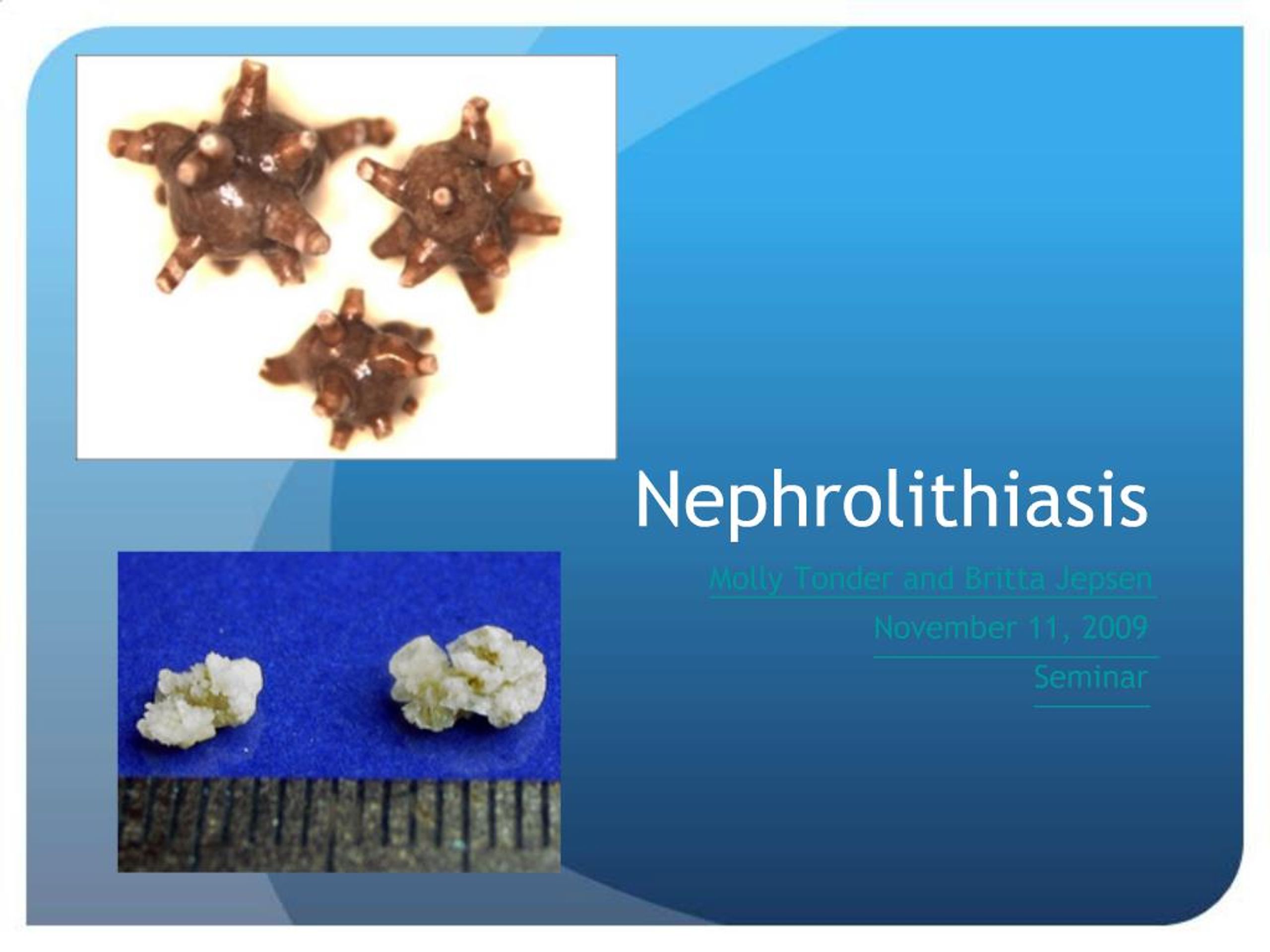 PPT - Nephrolithiasis PowerPoint Presentation, free download - ID:1053018