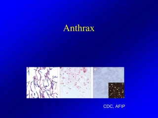 PPT - ANTHRAX PowerPoint Presentation, free download - ID:9862239