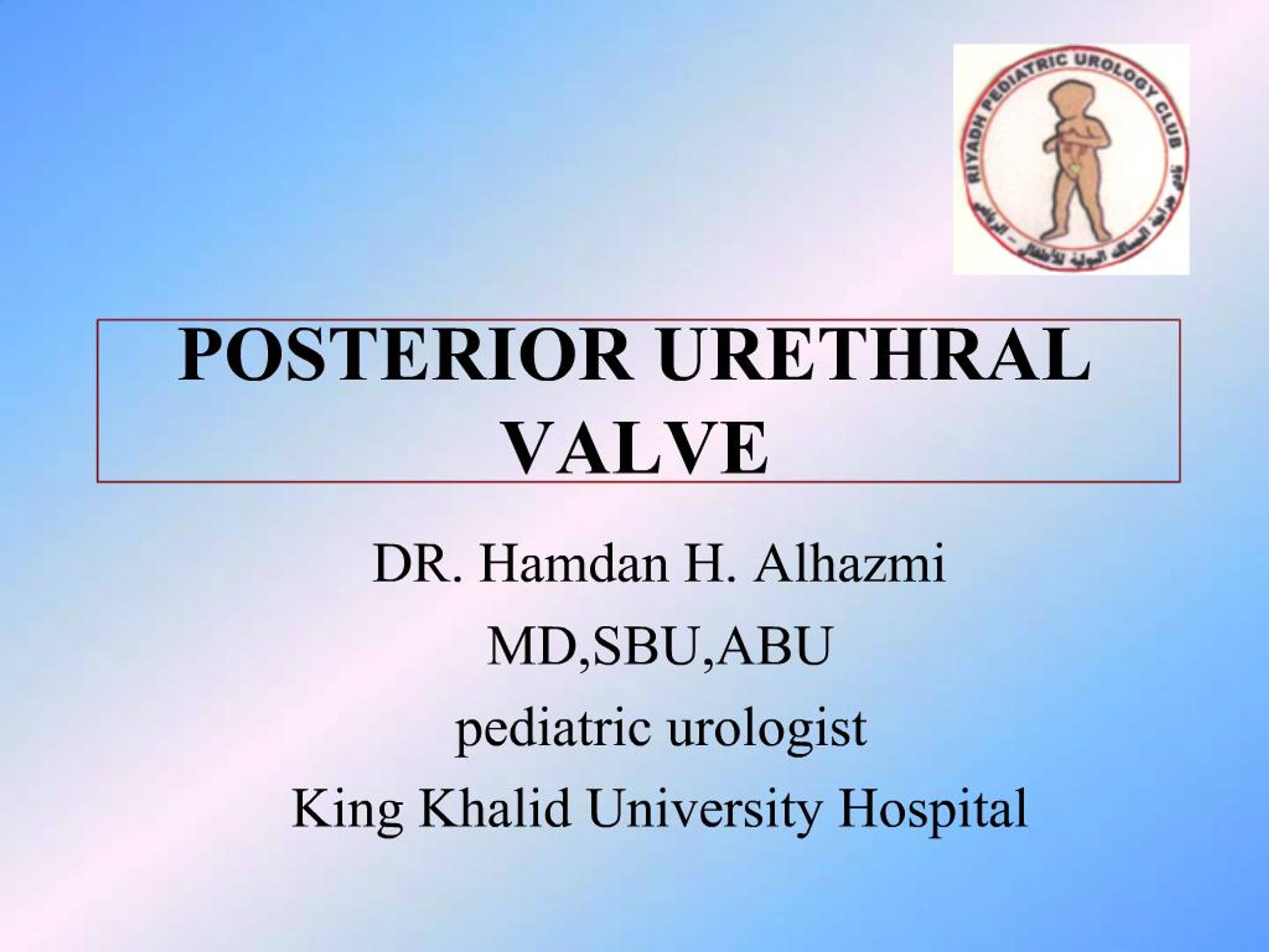 PPT - POSTERIOR URETHRAL VALVE PowerPoint Presentation, free download ...
