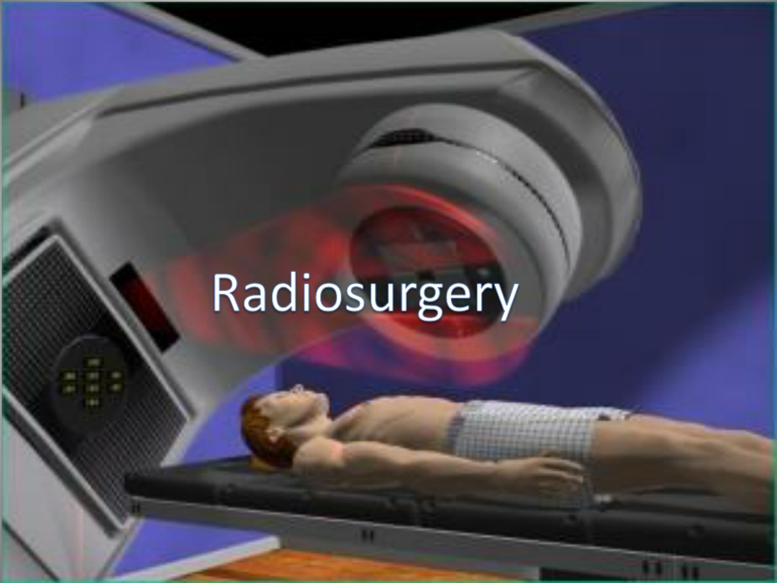 PPT - Radiosurgery PowerPoint Presentation, free download - ID:1303831