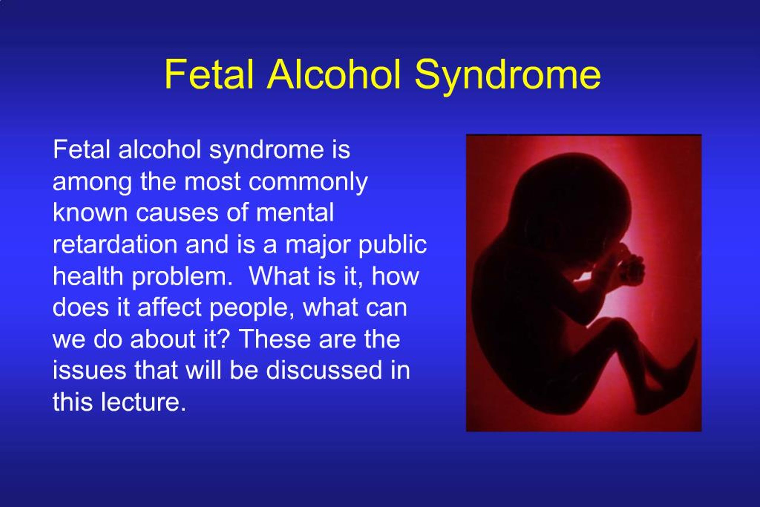 PPT - Fetal Alcohol Syndrome PowerPoint Presentation, free download ...