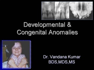 PPT - CONGENITAL OPTIC NERVE ANOMALIES PowerPoint Presentation, free ...
