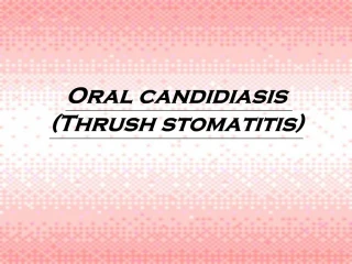 PPT - CANDIDIASIS PowerPoint Presentation, free download - ID:265068