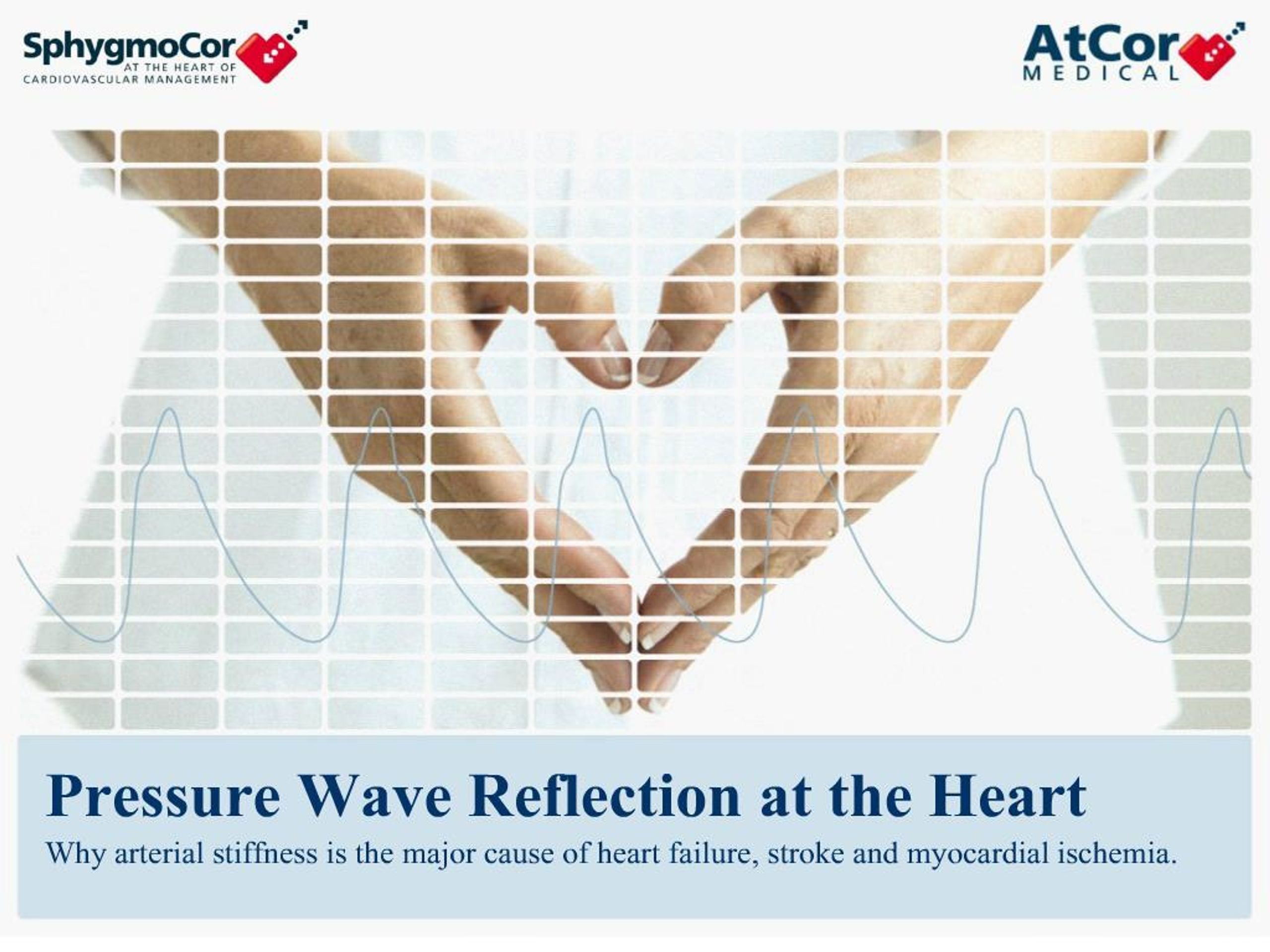 PPT - Pressure Wave Reflection at the Heart PowerPoint Presentation ...