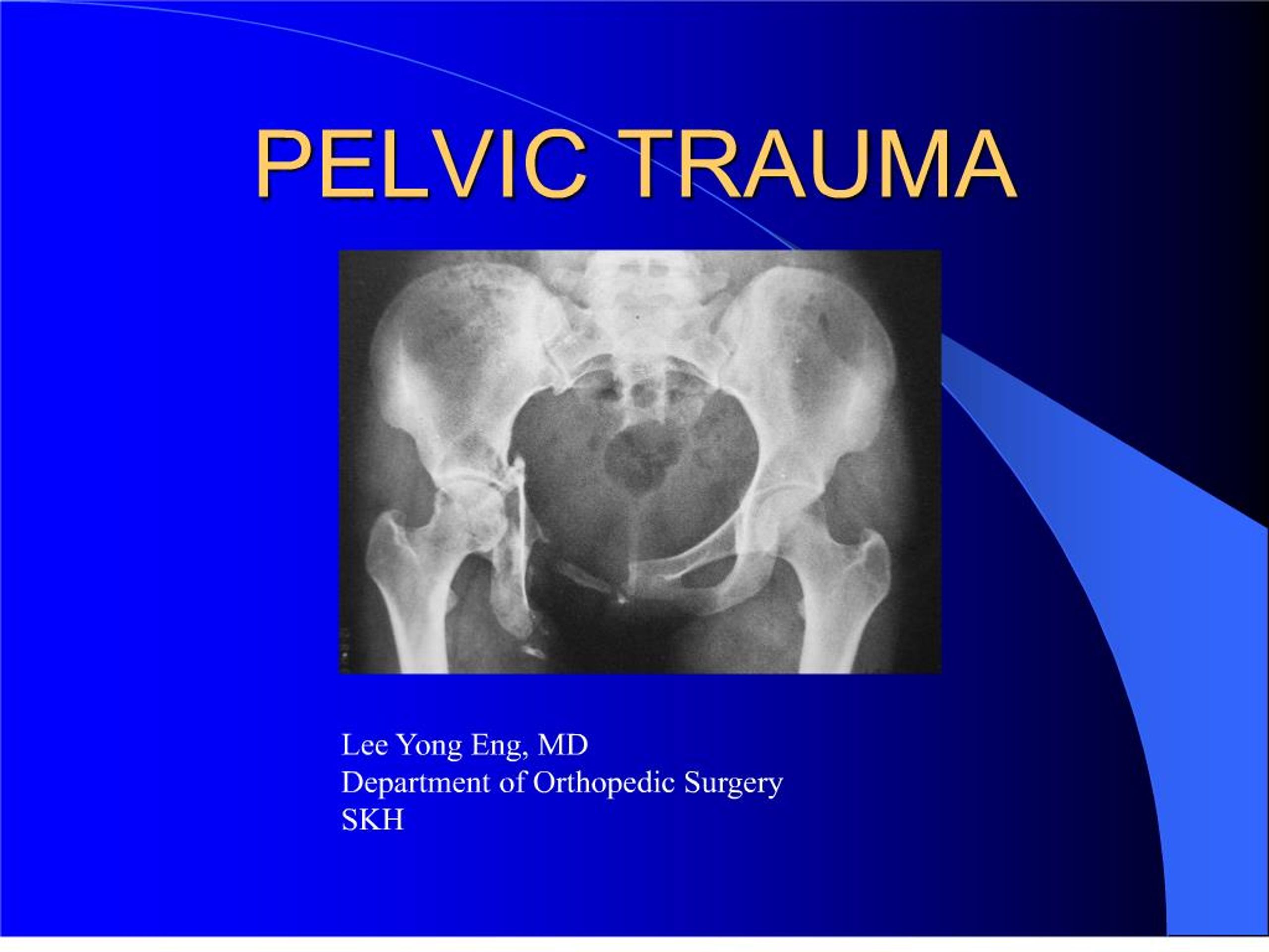 PPT - PELVIC TRAUMA PowerPoint Presentation, free download - ID:181848
