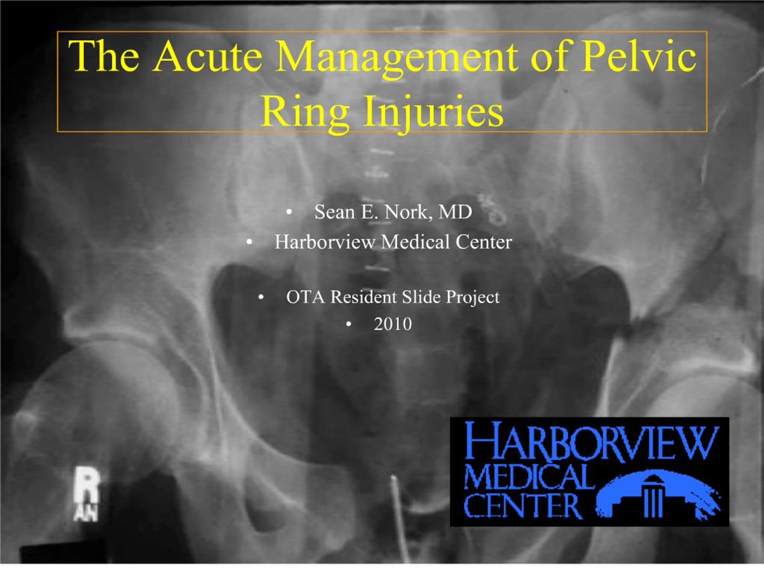 PPT - The Acute Management of Pelvic Ring Injuries PowerPoint ...