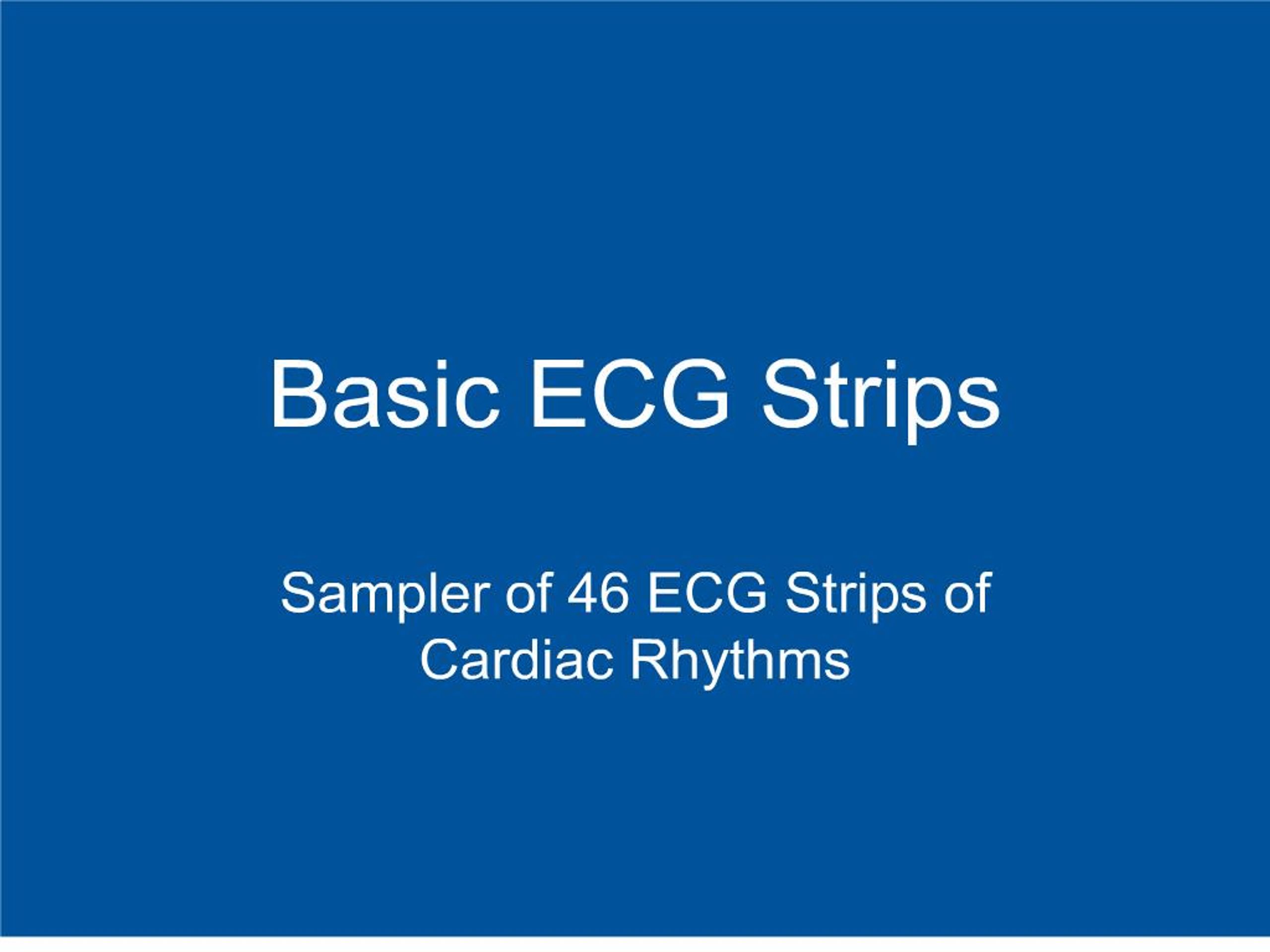 PPT - Basic ECG Strips PowerPoint Presentation, free download - ID:207187