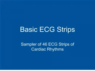 PPT - Basic ECG PowerPoint Presentation, free download - ID:4748985