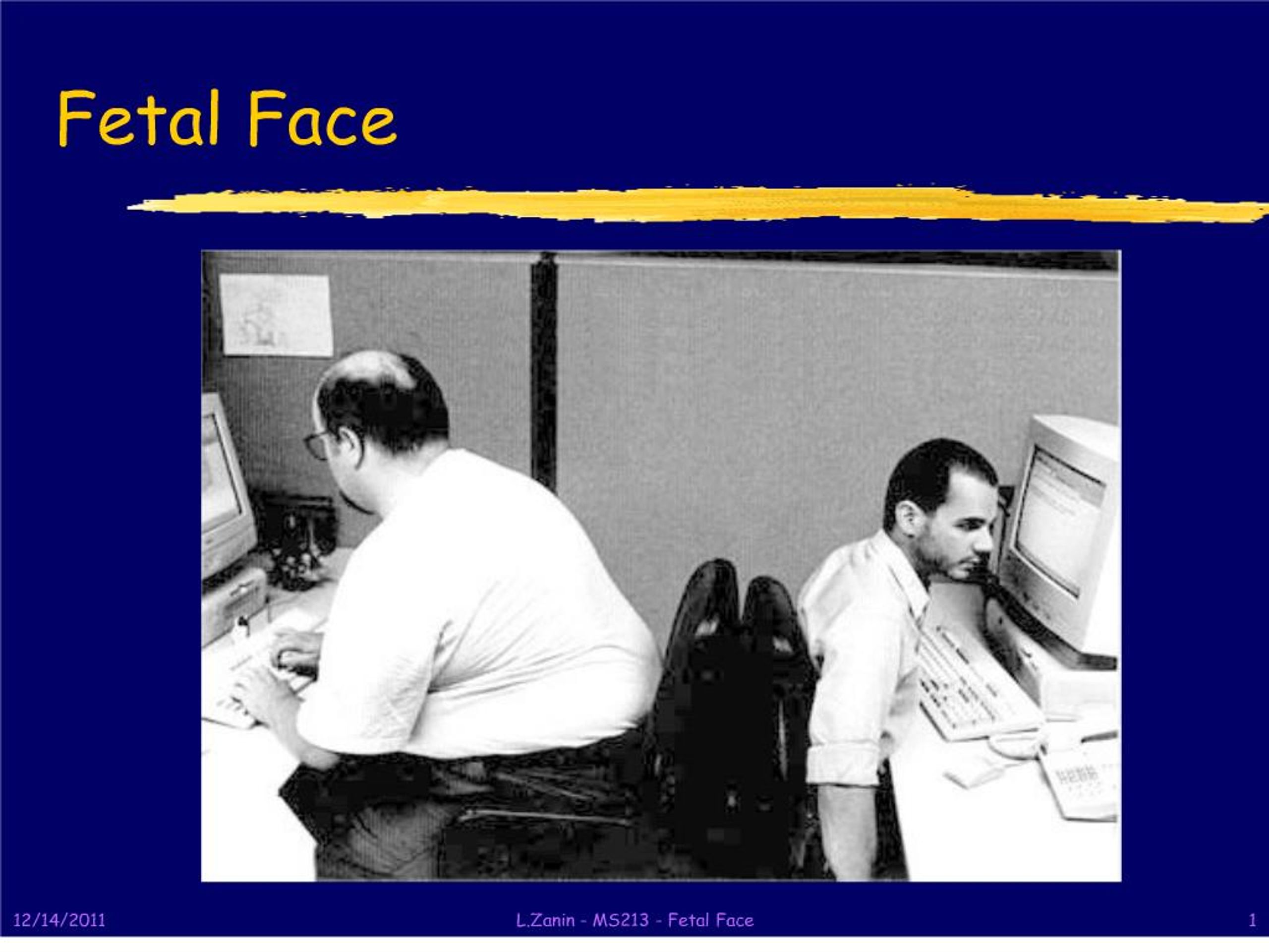 PPT - Fetal Face PowerPoint Presentation, free download - ID:211588