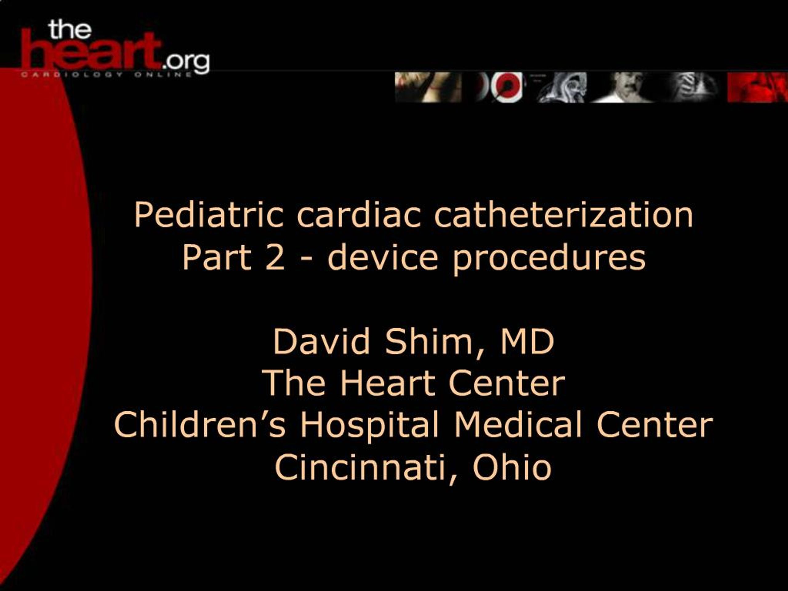 PPT - Pediatric cardiac catheterization Part 2 - device procedures ...