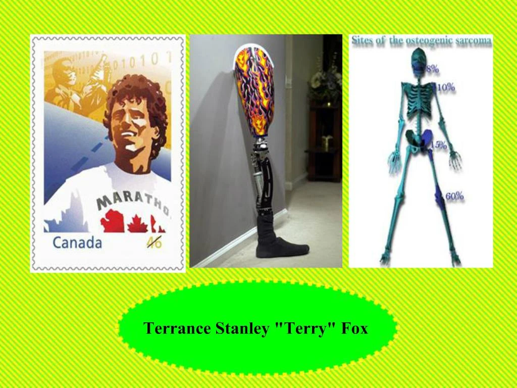 PPT - Terrance Stanley Terry Fox PowerPoint Presentation, free download ...