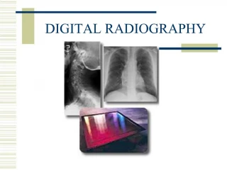 PPT - Bitewing radiography PowerPoint Presentation, free download - ID ...