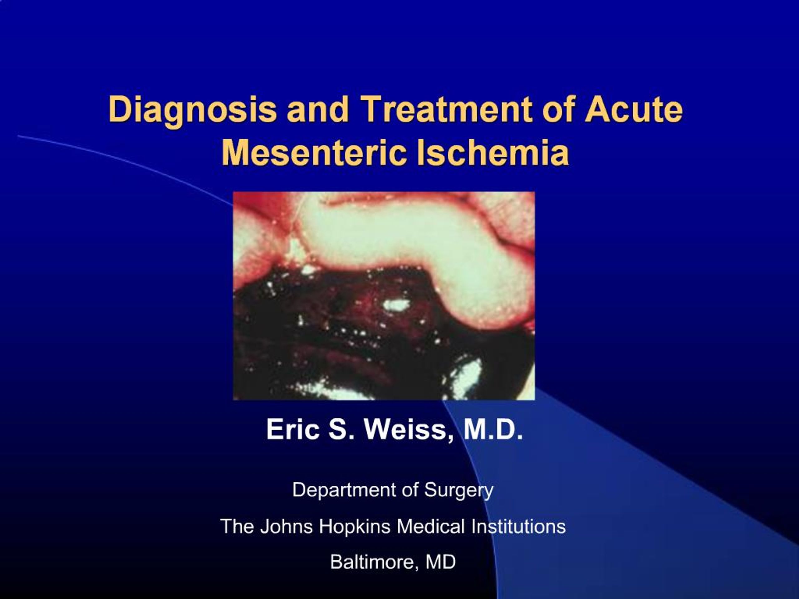 PPT - Diagnosis and Treatment of Acute Mesenteric Ischemia PowerPoint ...