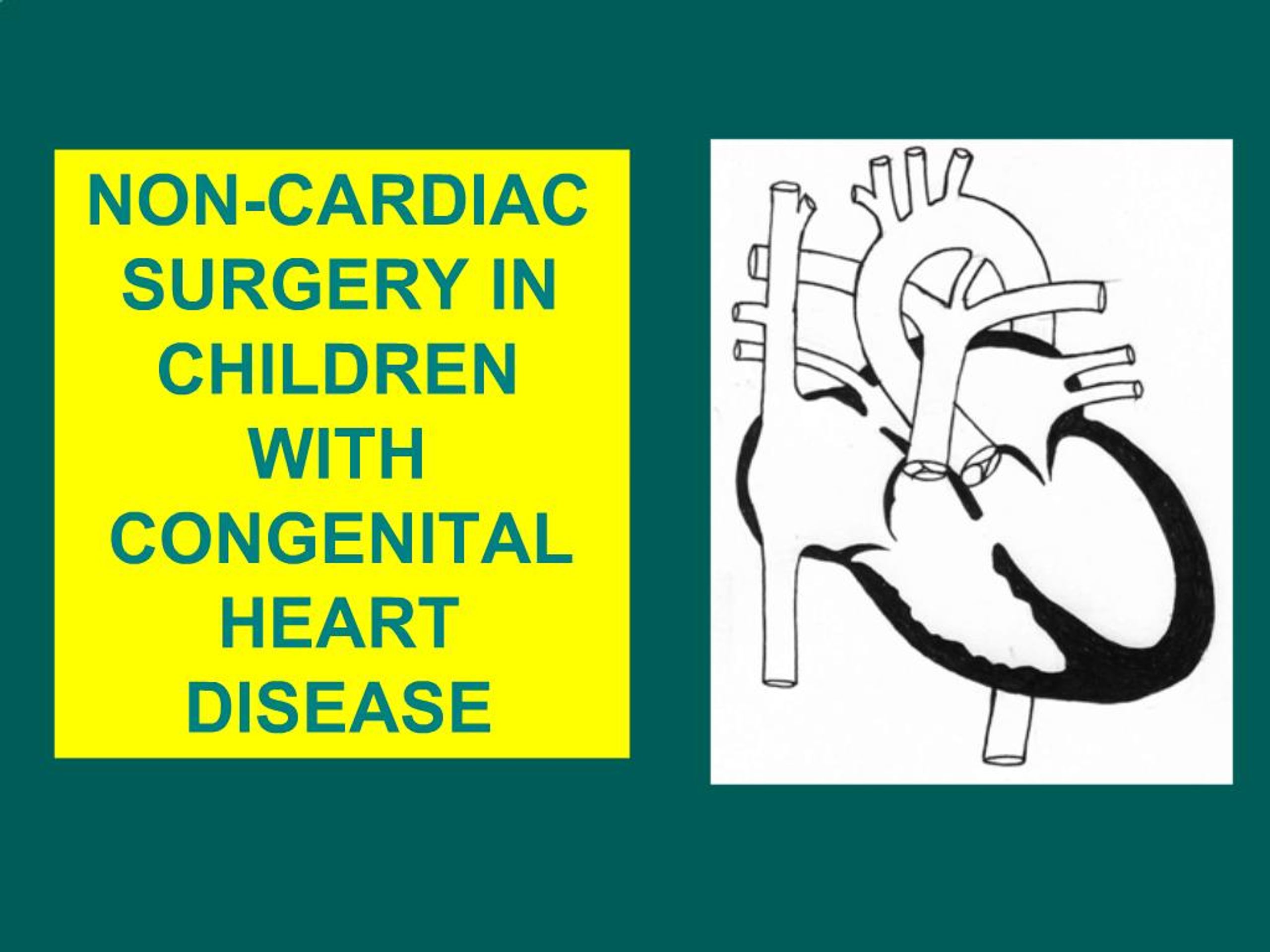 PPT - NON-CARDIAC SURGERY IN CHILDREN WITH CONGENITAL HEART DISEASE ...