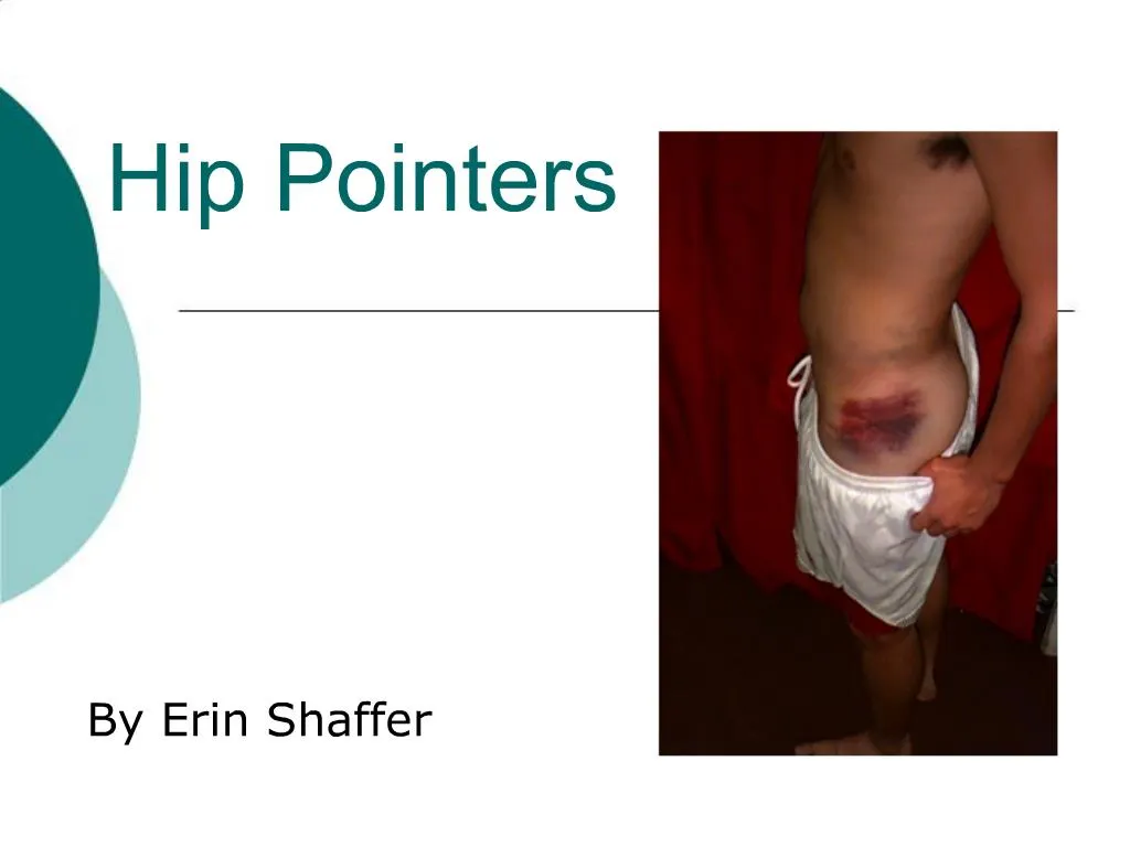 PPT - Hip Pointers PowerPoint Presentation, free download - ID:606873