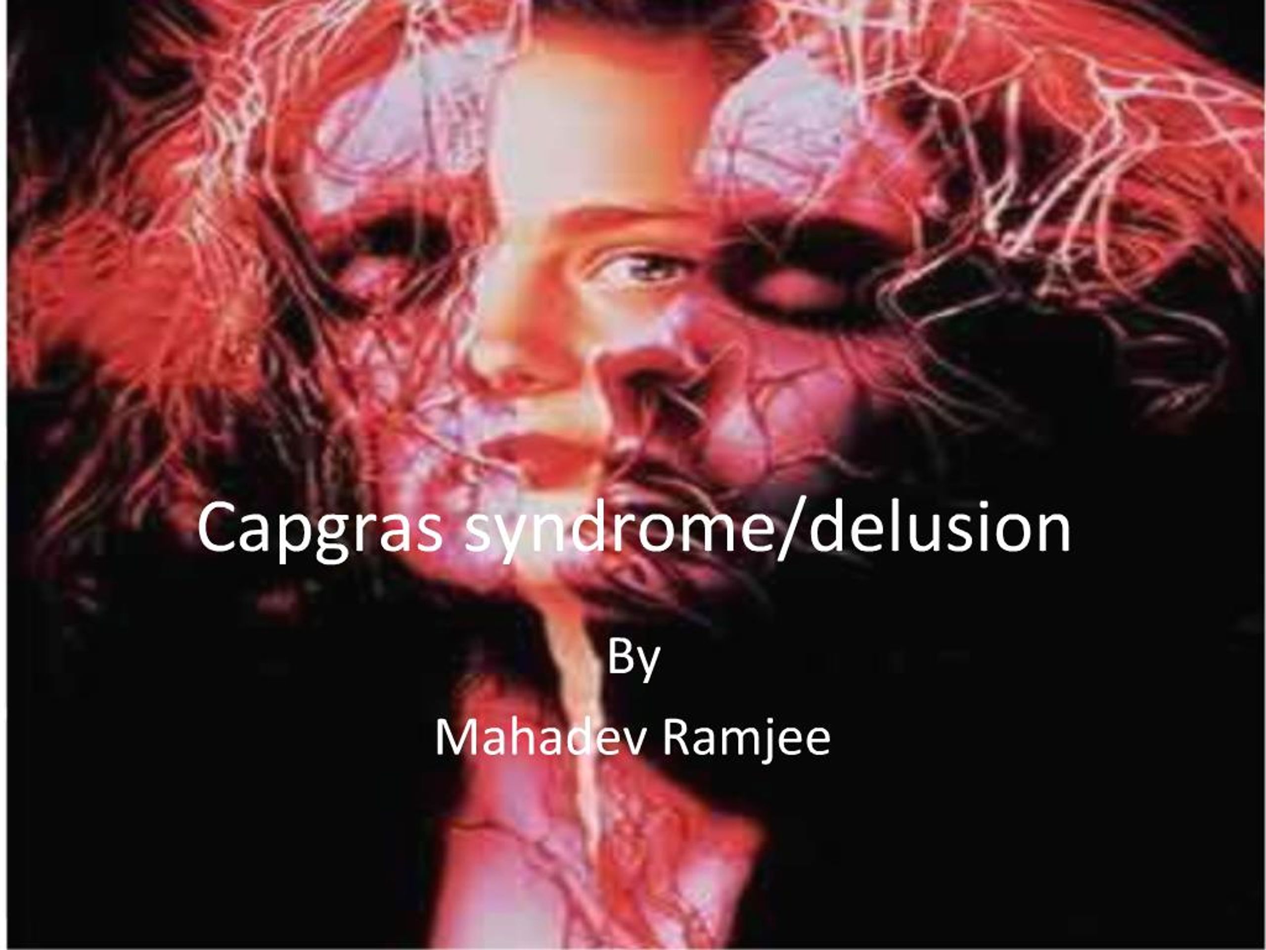 PPT - Capgras syndrome PowerPoint Presentation, free download - ID:632384