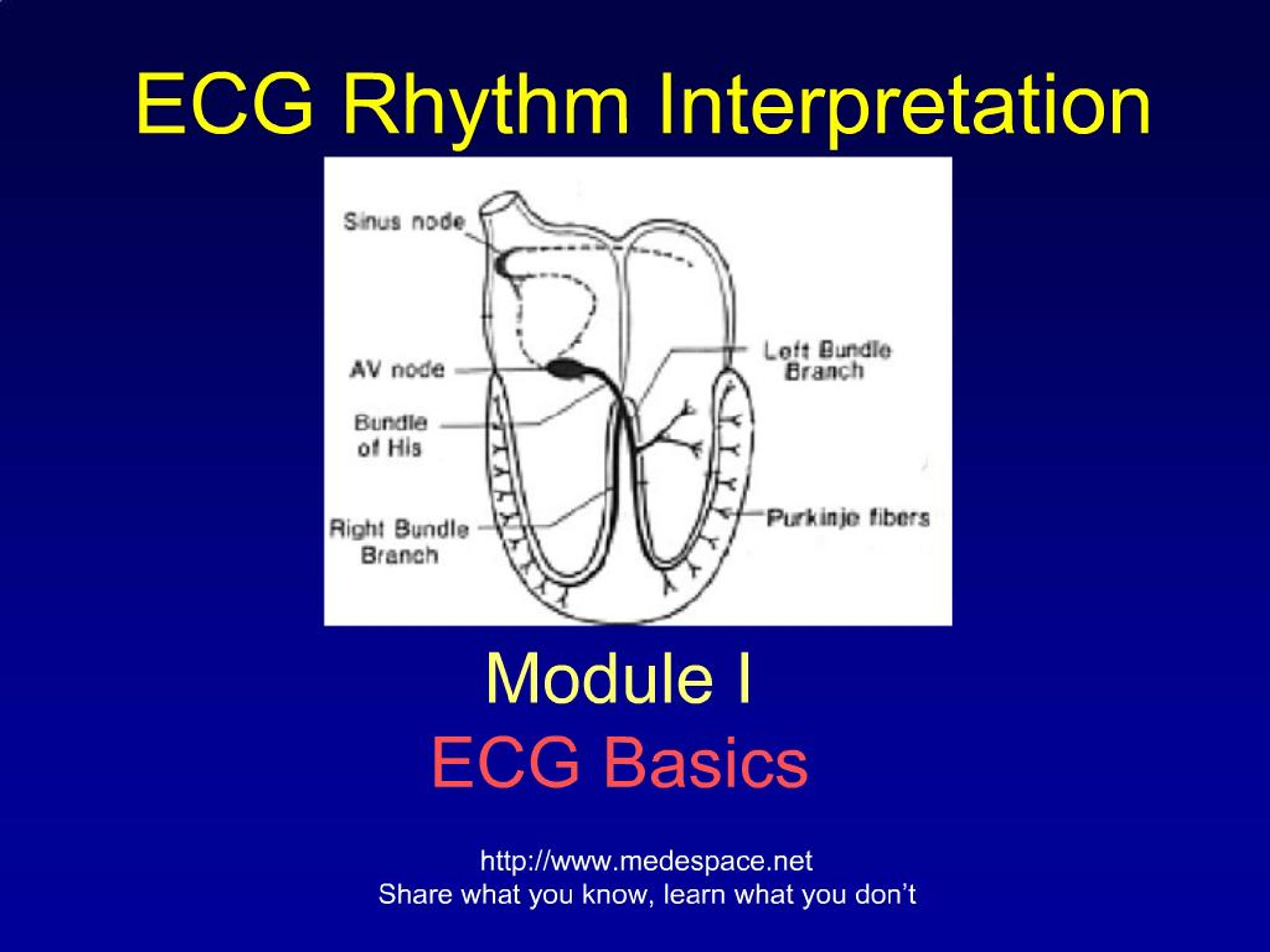 PPT - ECG Rhythm Interpretation PowerPoint Presentation, free download ...