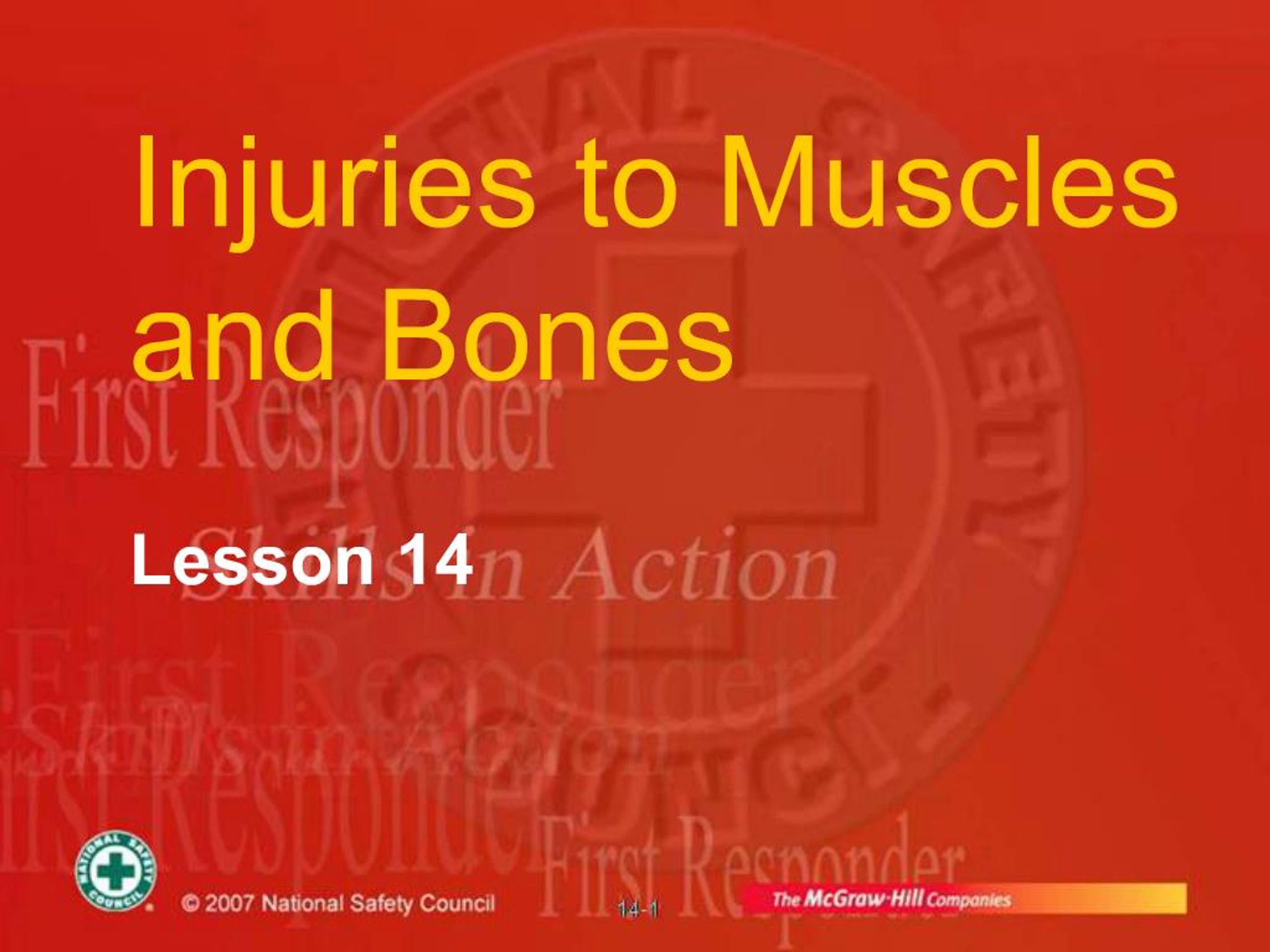 PPT - Injuries to Muscles and Bones PowerPoint Presentation, free ...
