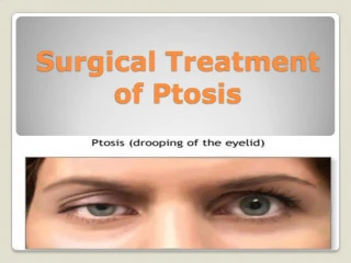 PPT - CLASSIFICATION OF PTOSIS PowerPoint Presentation, free download ...