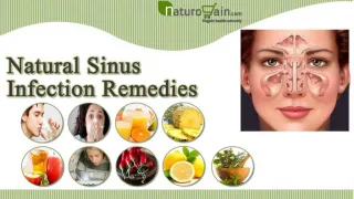 PPT - Natural Homeopathy for Sinus Difficulties PowerPoint Presentation ...