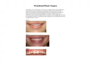 PPT - Periodontal Flap Surgery PowerPoint Presentation, free download ...