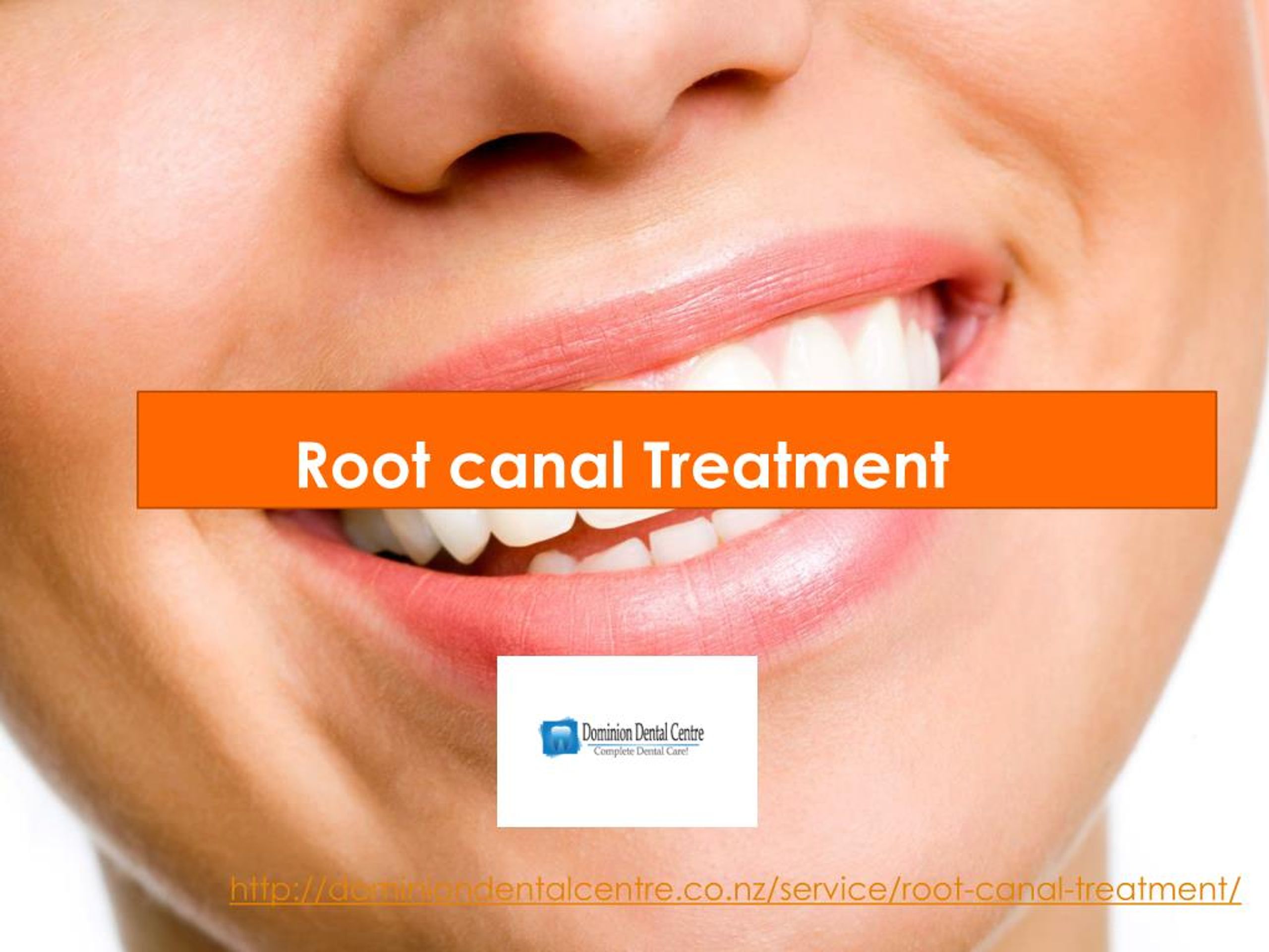 PPT - Root Canal Treatment PowerPoint Presentation, free download - ID ...