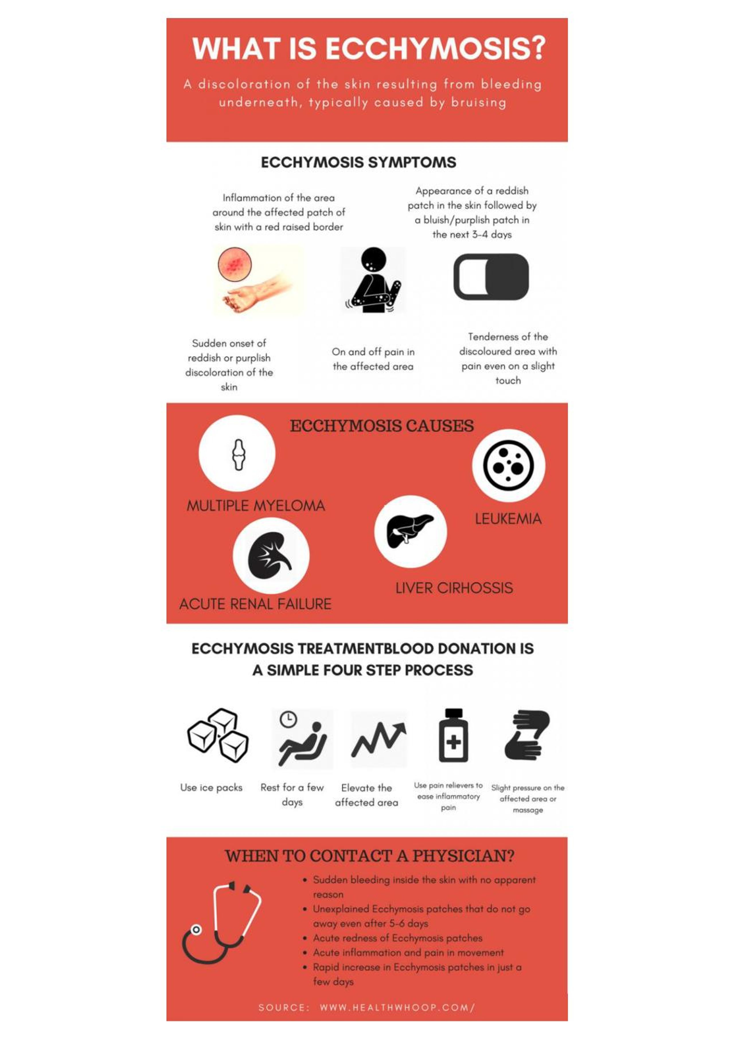 PPT - WHAT IS ECCHYMOSIS? PowerPoint Presentation, free download - ID ...
