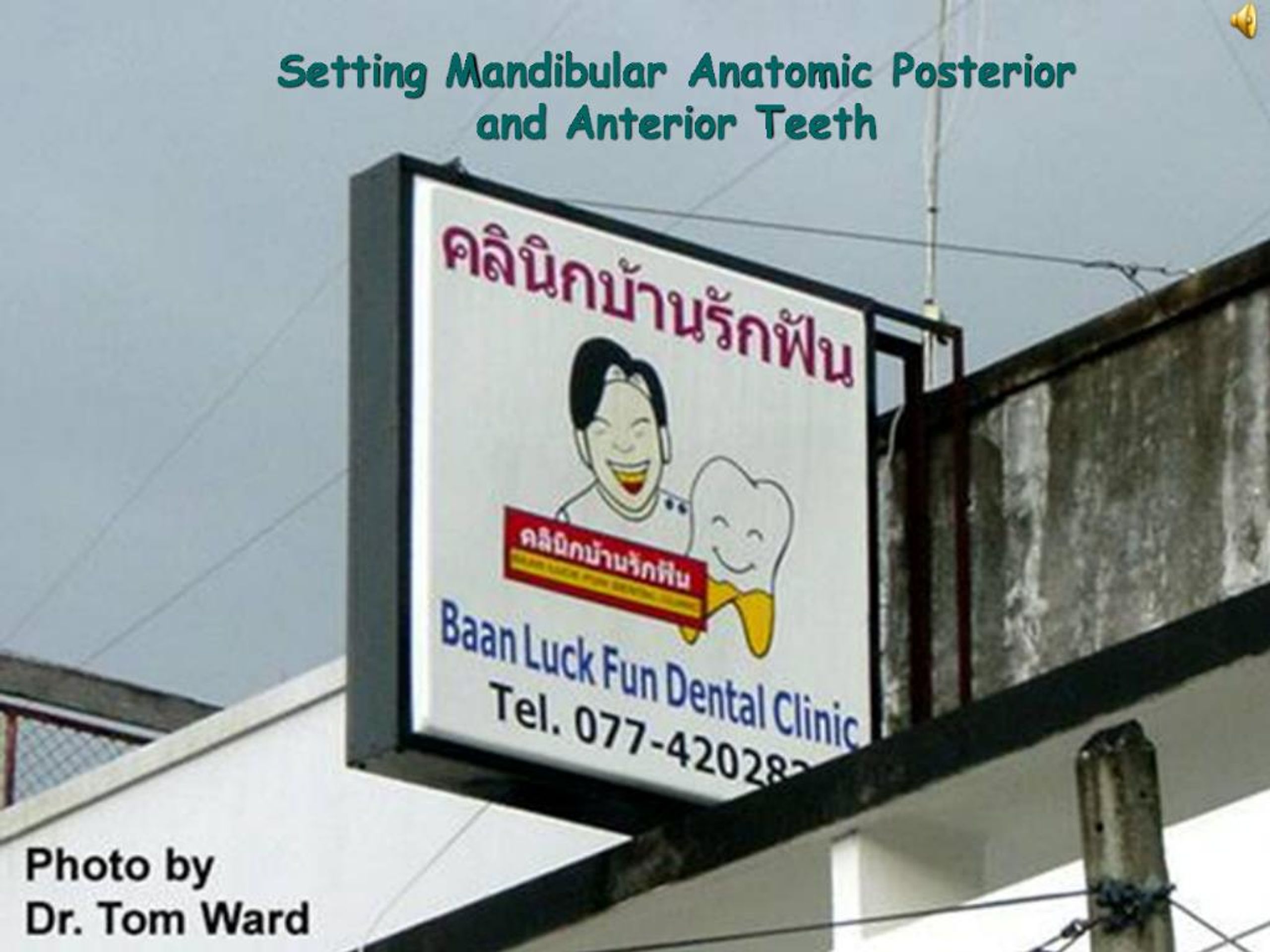 PPT - Setting Mandibular Anatomic Posterior and Anterior Teeth ...