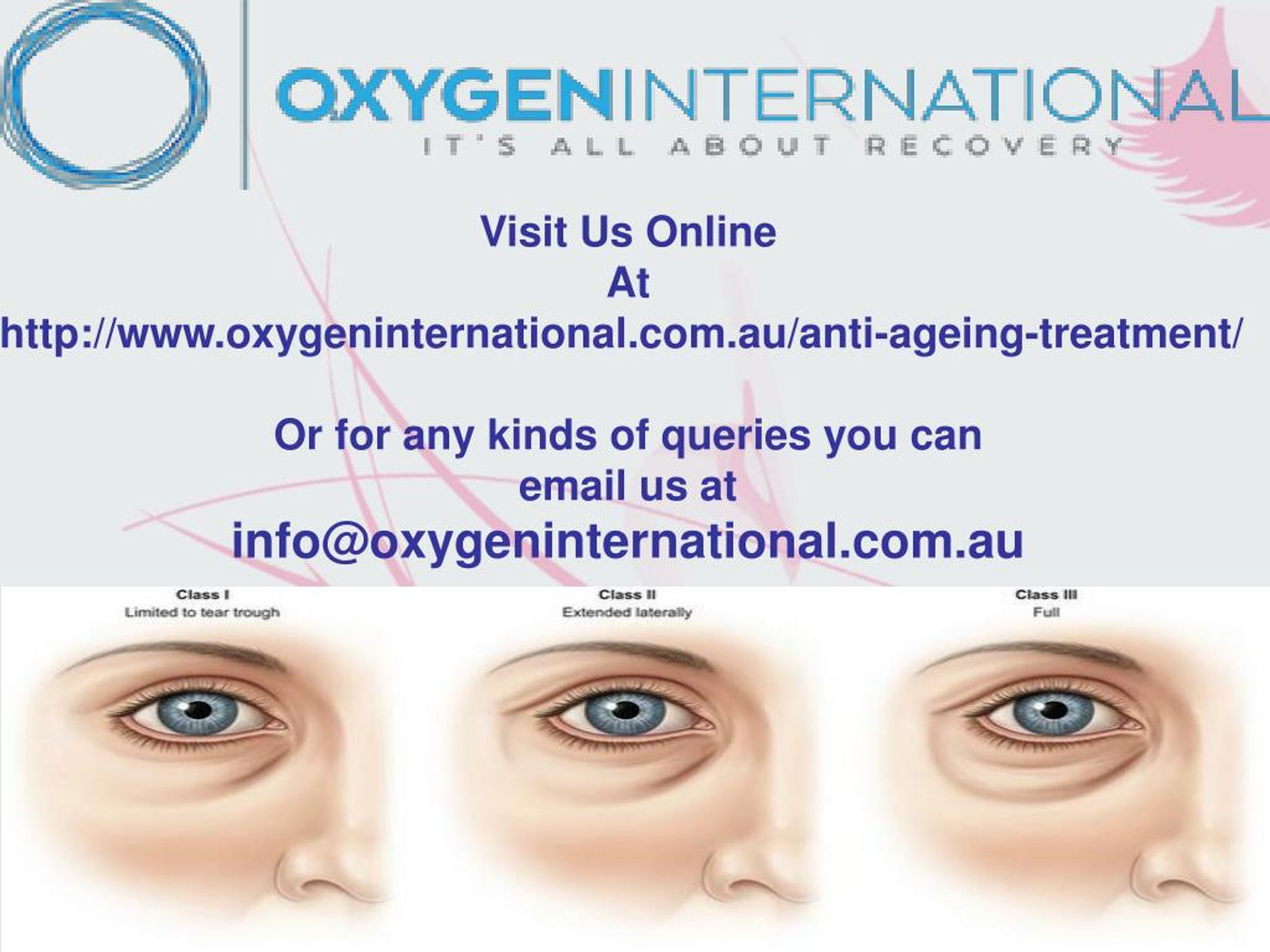 PPT - Tear Trough PowerPoint Presentation, free download - ID:7484670