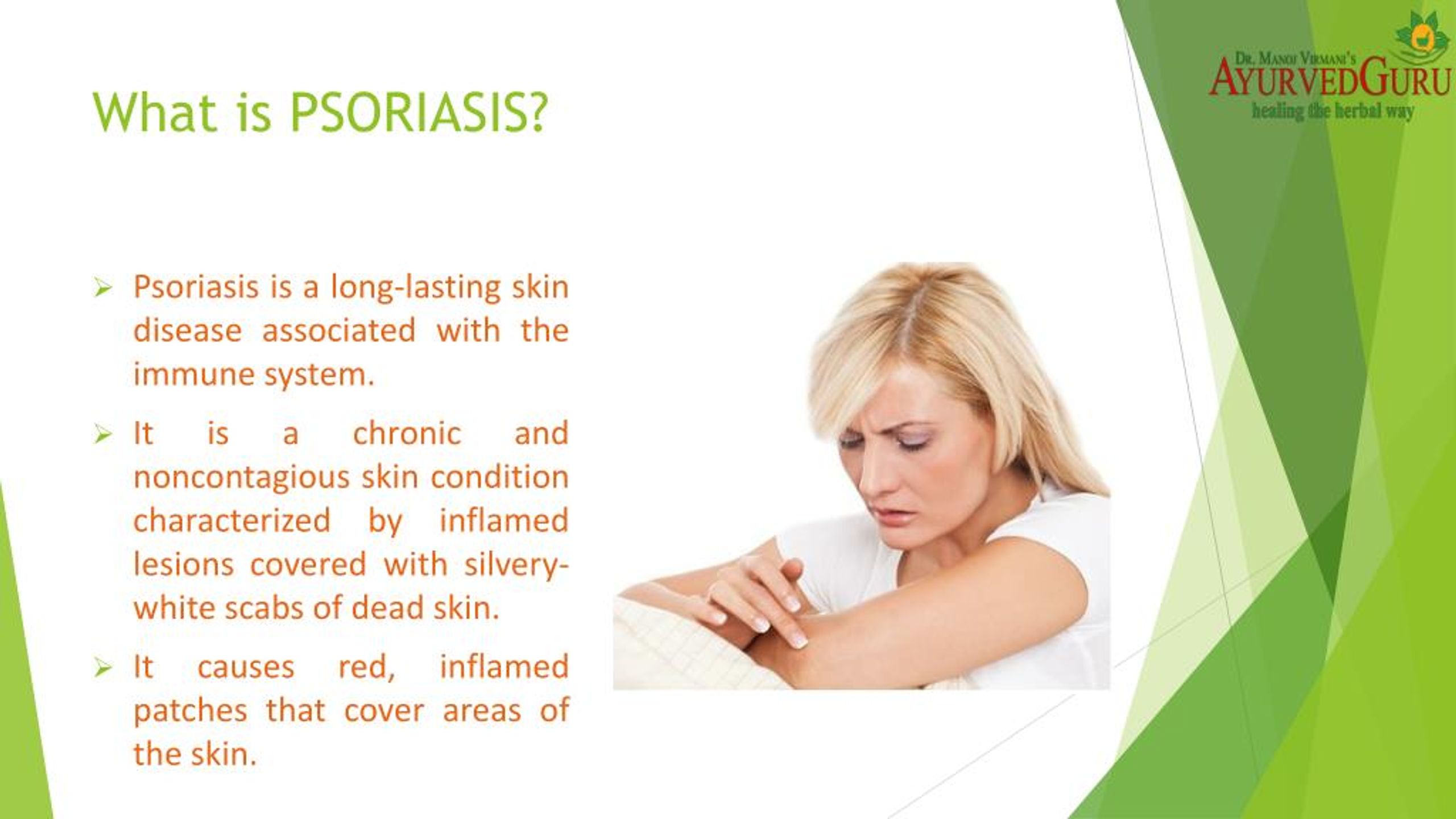 PPT - PSORIASIS TREATMENT PowerPoint Presentation, free download - ID ...