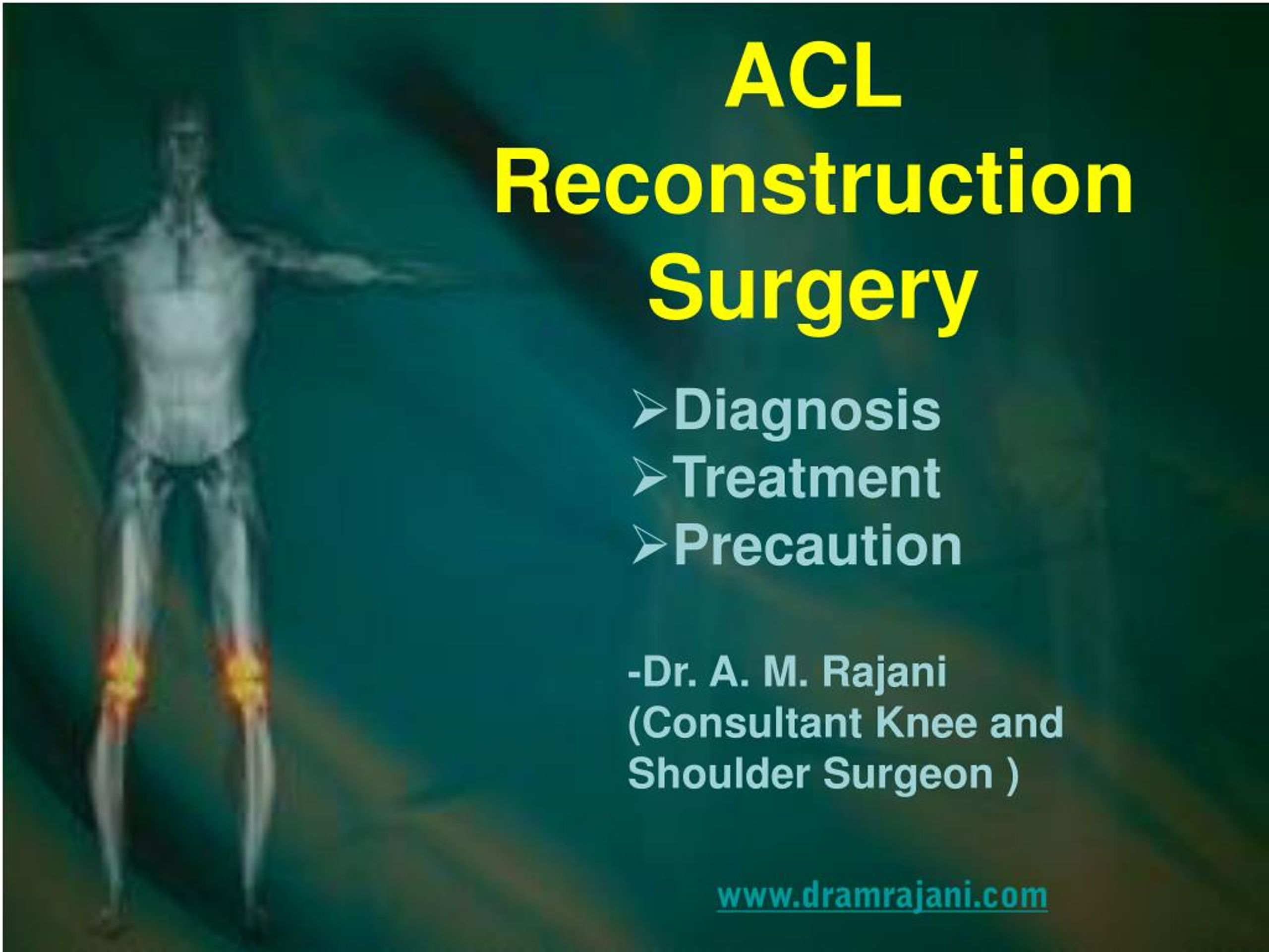 PPT - ACL Reconstruction Surgery: Diagnosis, Treatment, Precaution ...