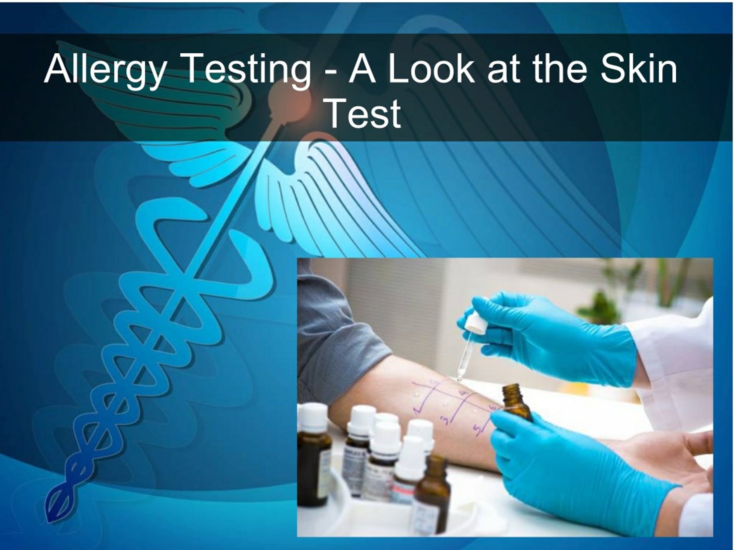 PPT - Allergy Testing - A Look at the Skin Test PowerPoint Presentation ...