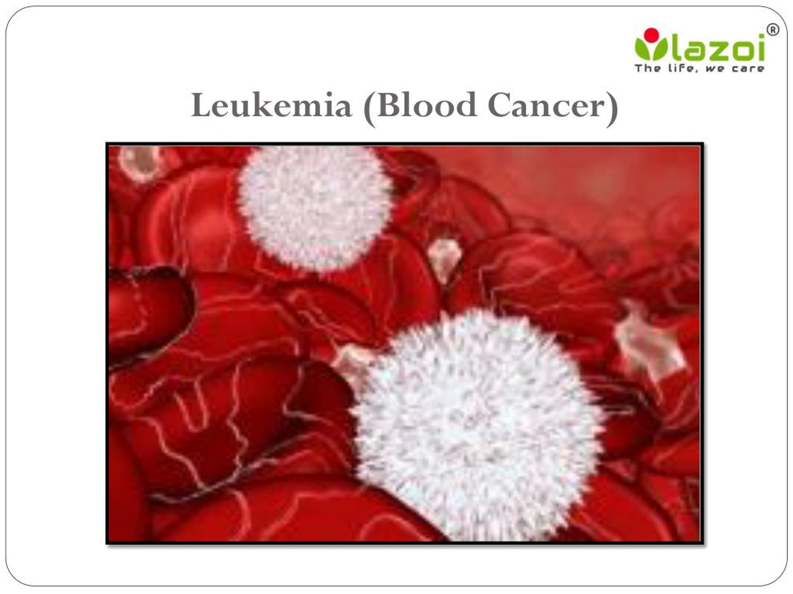PPT - Leukemia (Blood Cancer) PowerPoint Presentation, free download ...