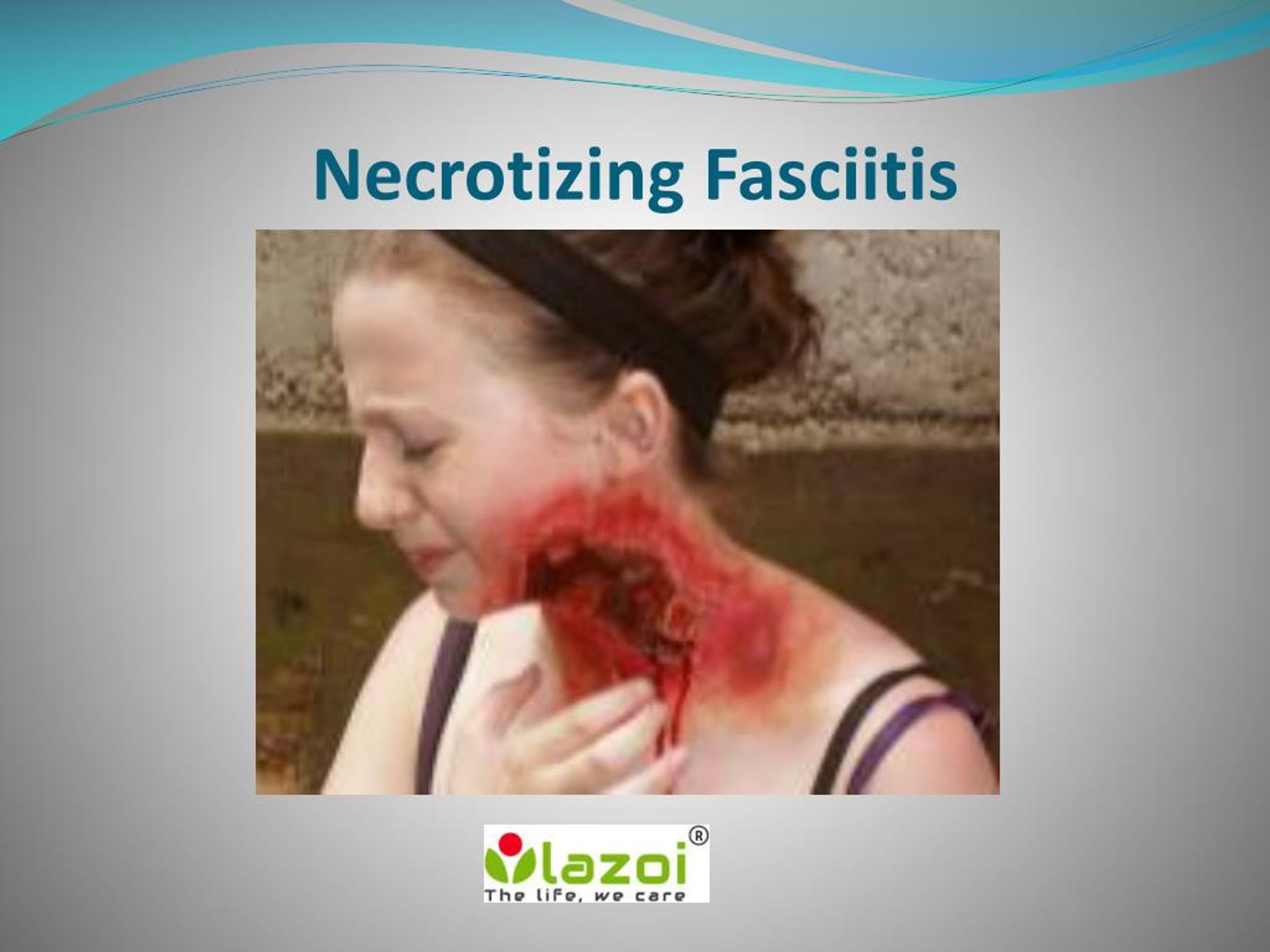 PPT - Necrotizing Fasciitis: Symptoms, Causes, Diagnosis and Treatment ...