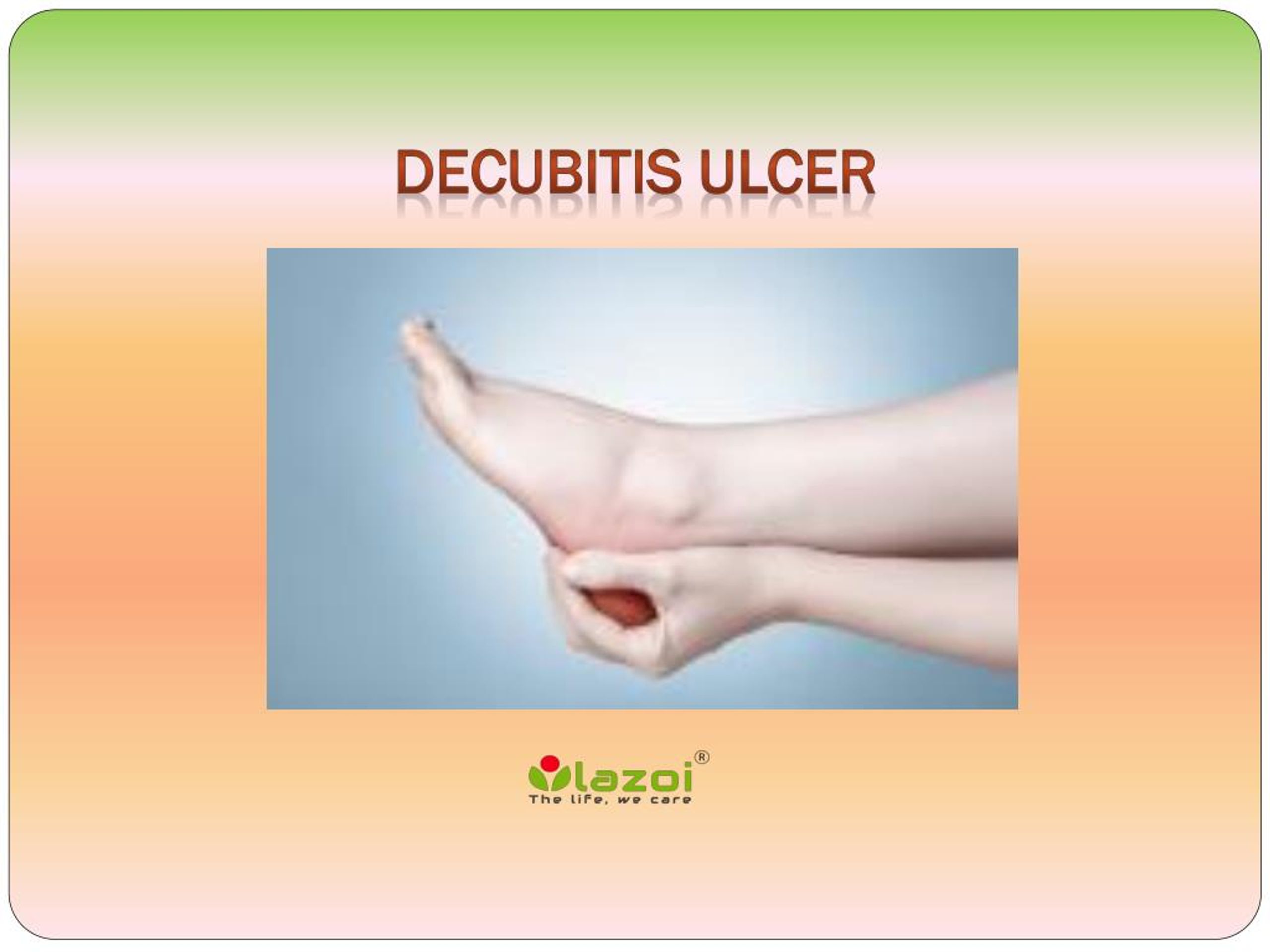PPT - Decubitis Ulcer: Symptoms, Causes, Risk factors, Diagnosis ...