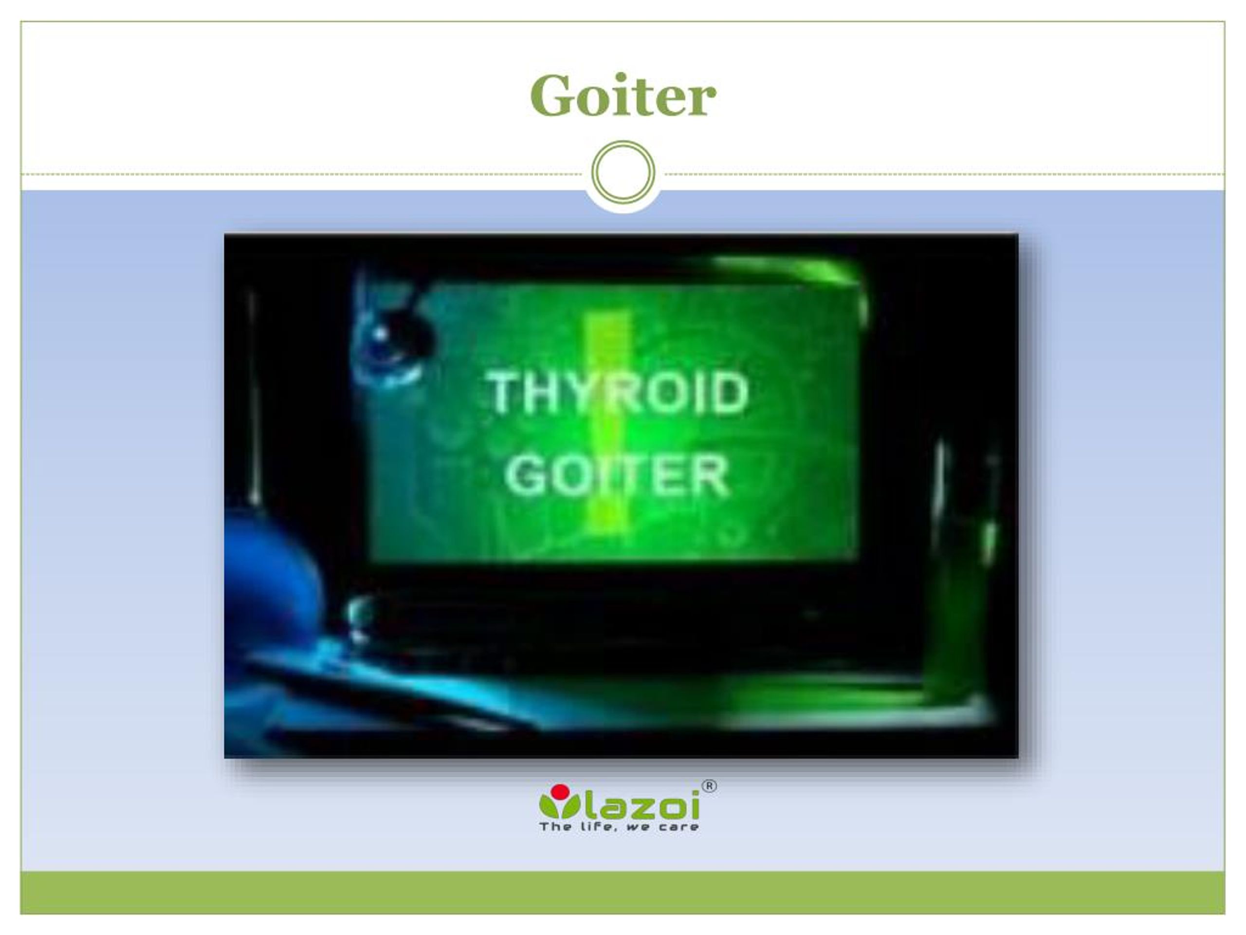 PPT - Goiter: Read about symptoms, causes and treatment PowerPoint ...