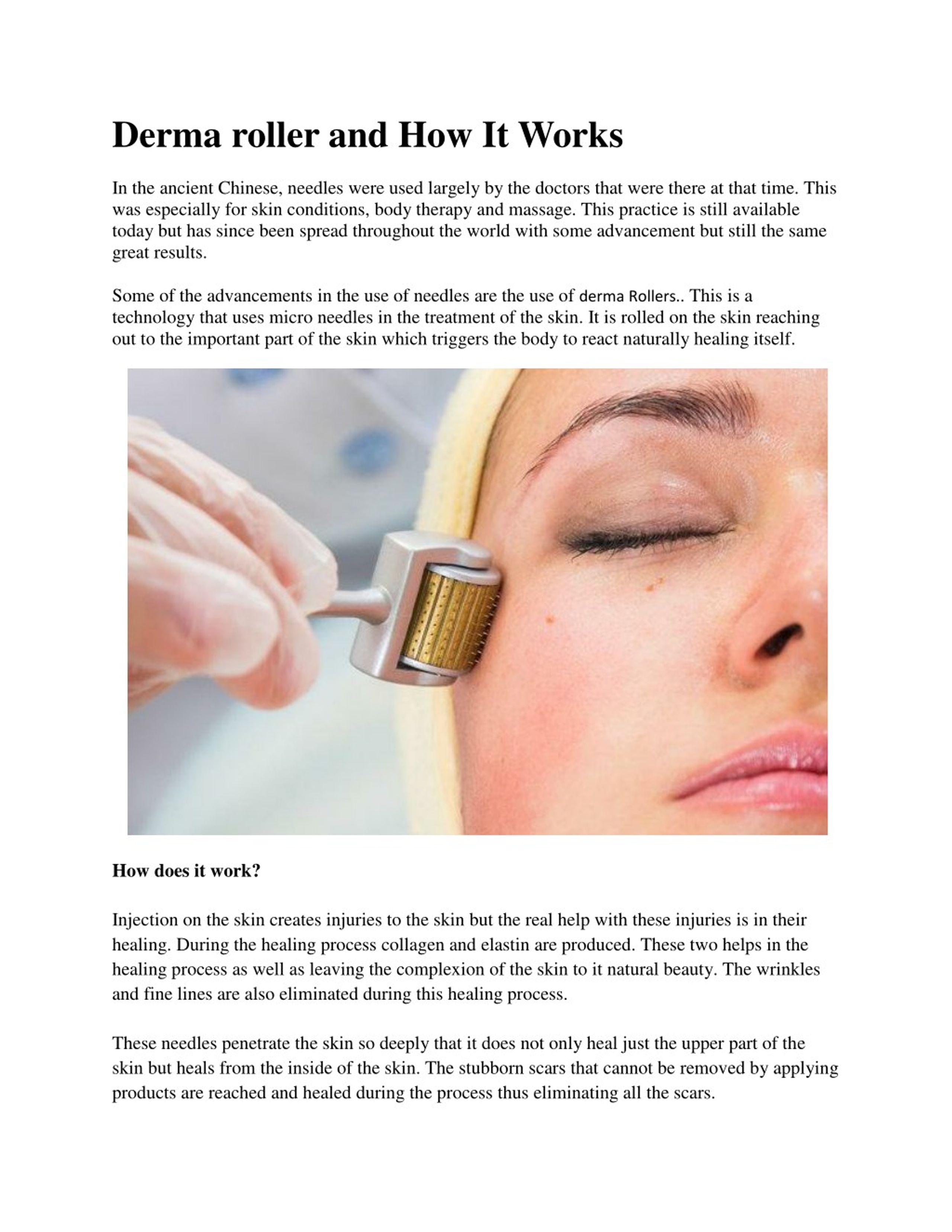 PPT - Derma roller and How It Works PowerPoint Presentation, free ...