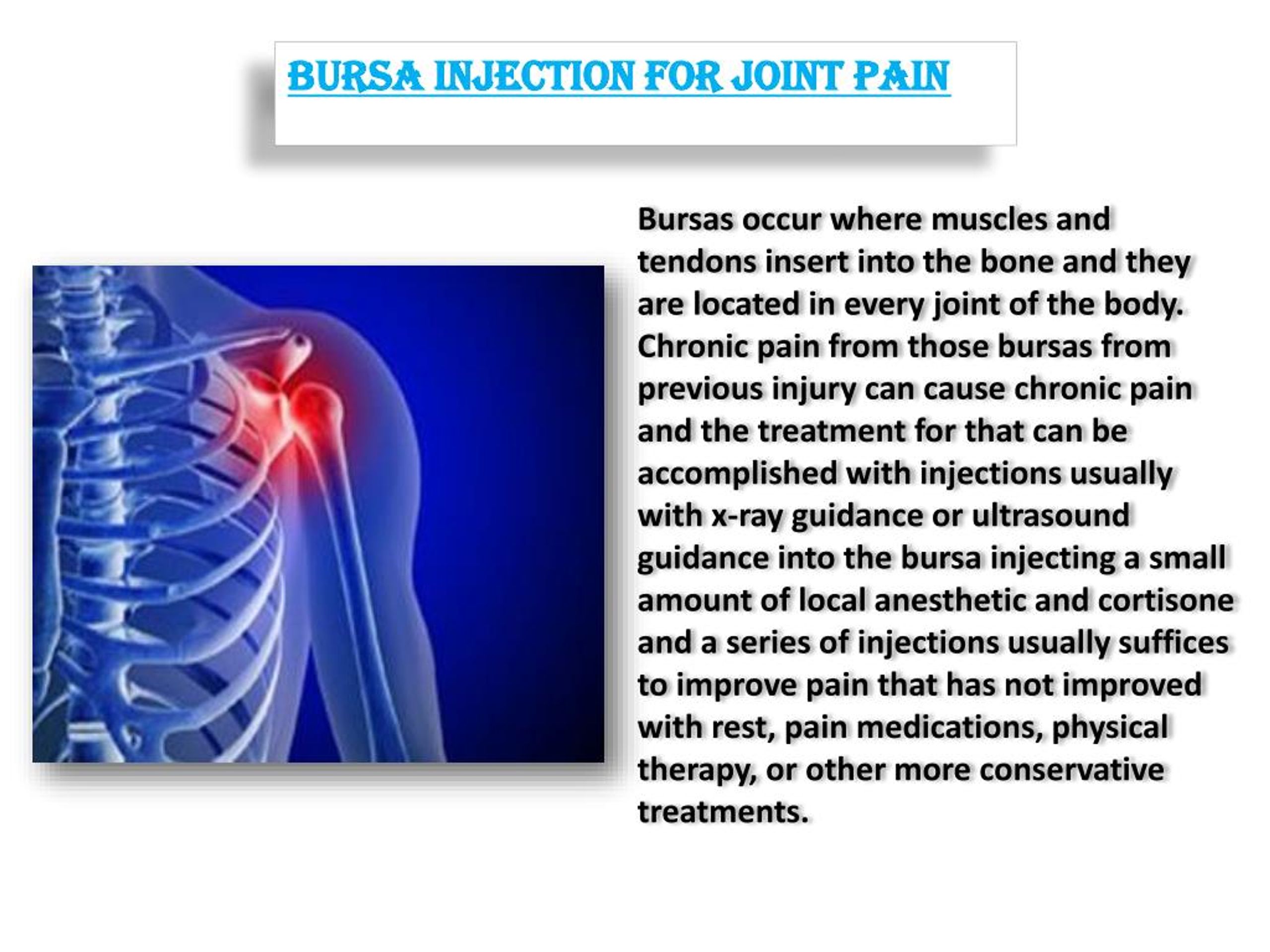 PPT - Bursa Injection for Joint Pain PowerPoint Presentation, free ...