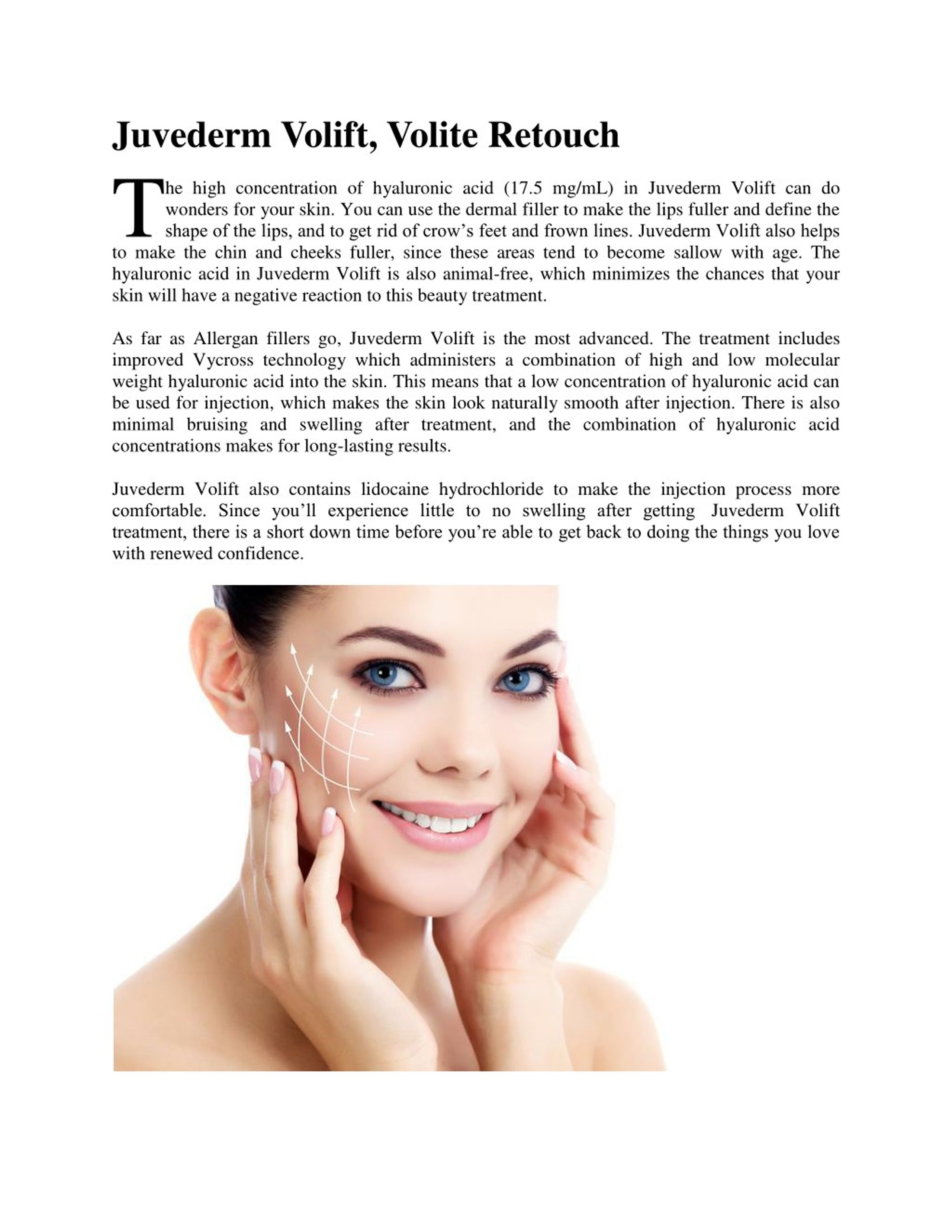 PPT - Juvederm Volift, Volite Retouch PowerPoint Presentation, free ...
