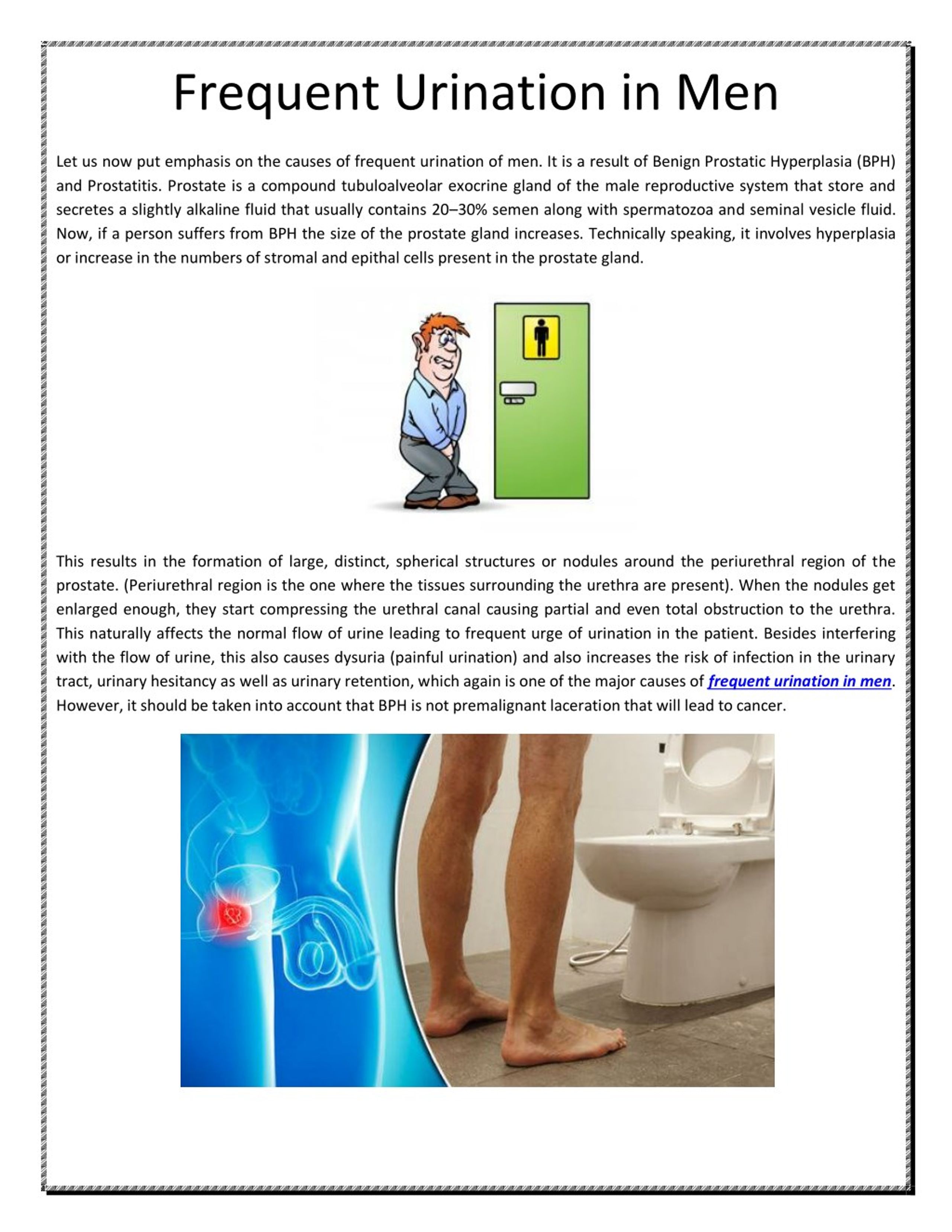 PPT - Frequent Urination in Men PowerPoint Presentation, free download ...