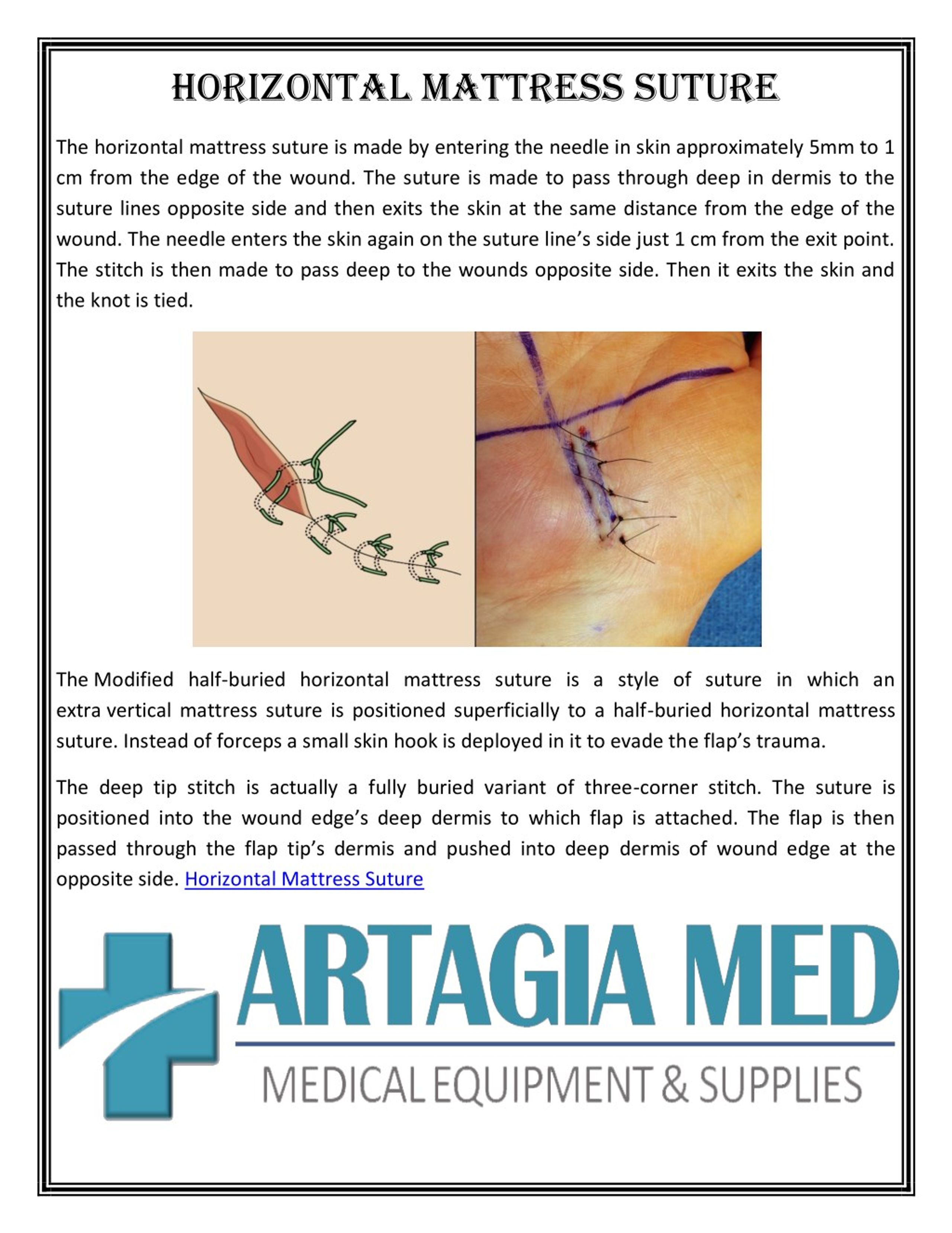 PPT - Horizontal Mattress Suture PowerPoint Presentation, free download ...