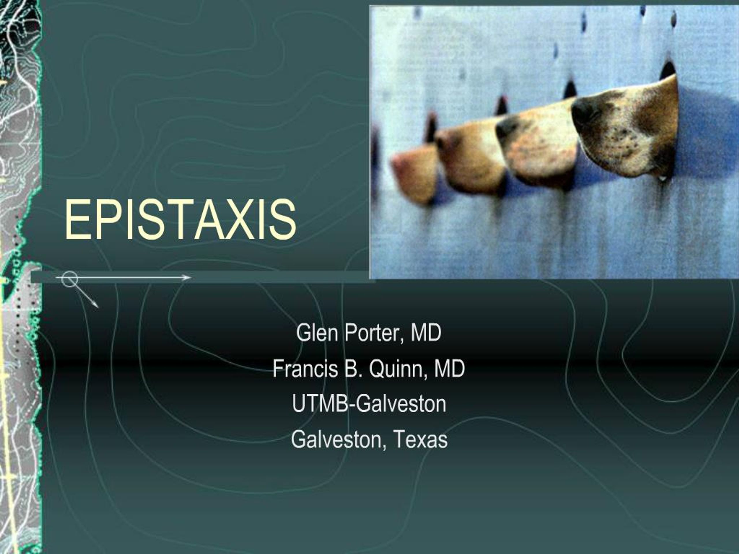 PPT - EPISTAXIS PowerPoint Presentation, free download - ID:792641