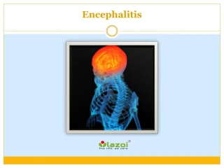 PPT - Epidemic Encephalitis B PowerPoint Presentation, free download ...