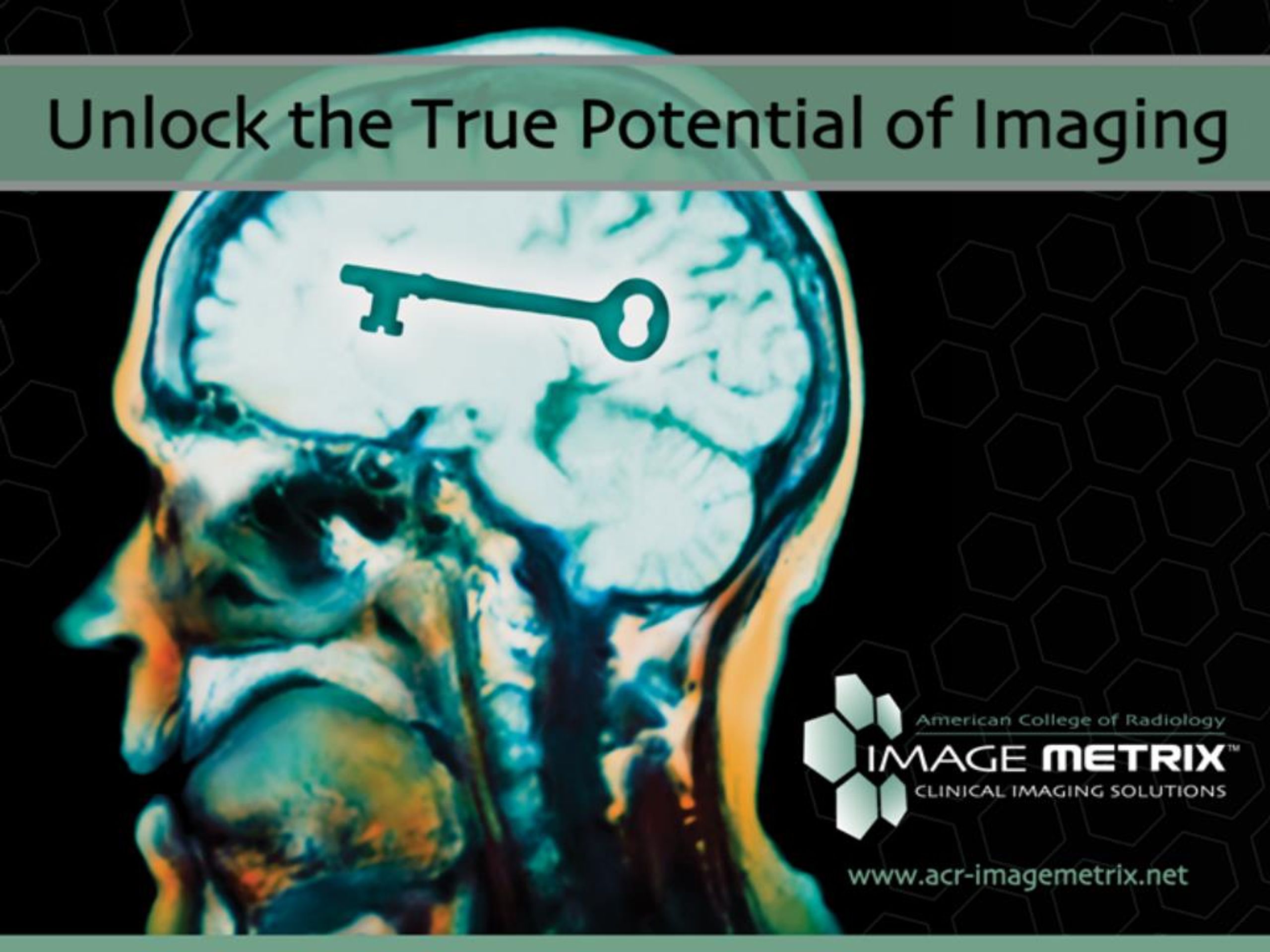 PPT - Advanced Imaging in Drug Development PowerPoint Presentation ...