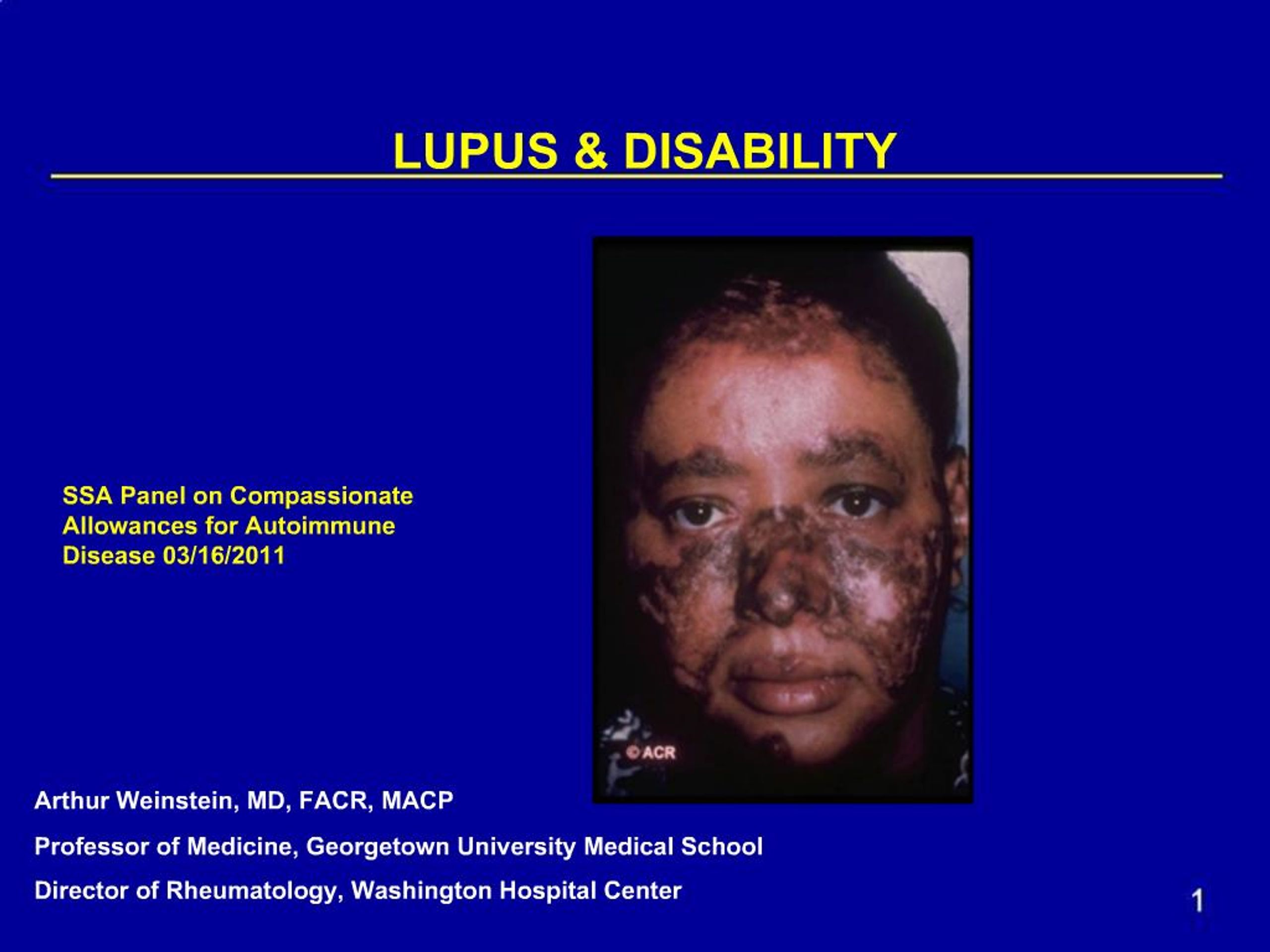 PPT - LUPUS DISABILITY PowerPoint Presentation, free download - ID:796096