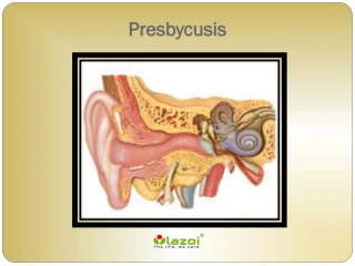 PPT - PRESBYCUSIS PowerPoint Presentation, free download - ID:2957165