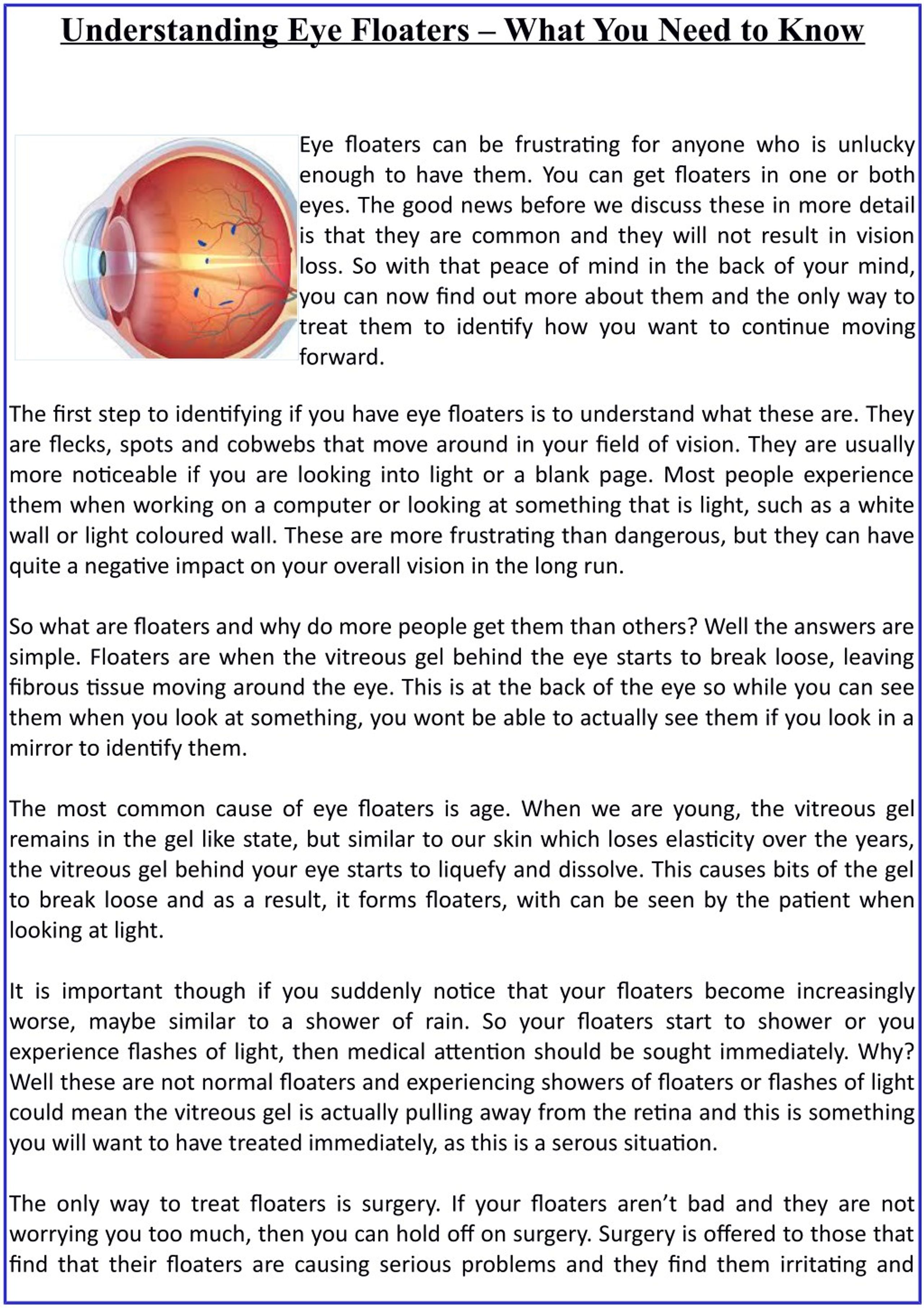 PPT - Understanding Eye Floaters – What You Need to Know PowerPoint ...